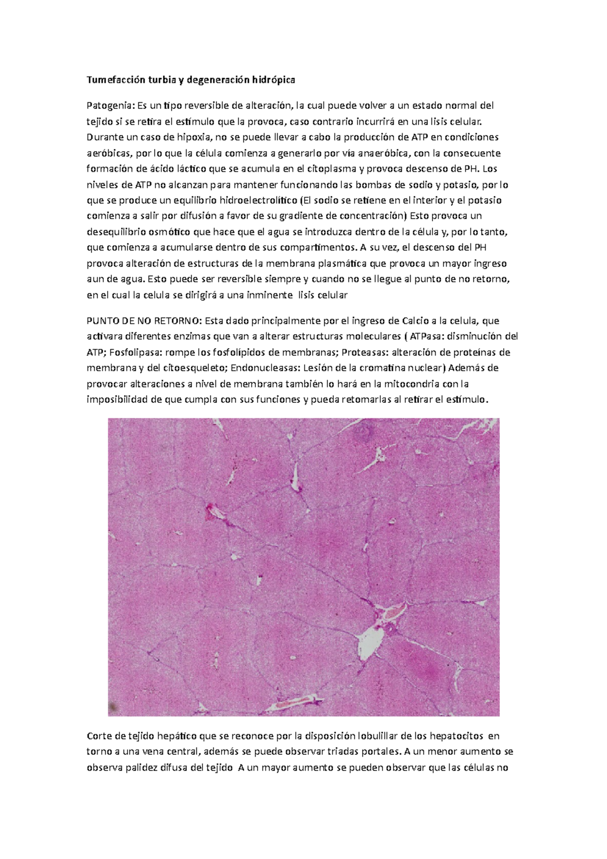 Preparados Patologia - Tumefacción turbia y degeneración hidrópica ...