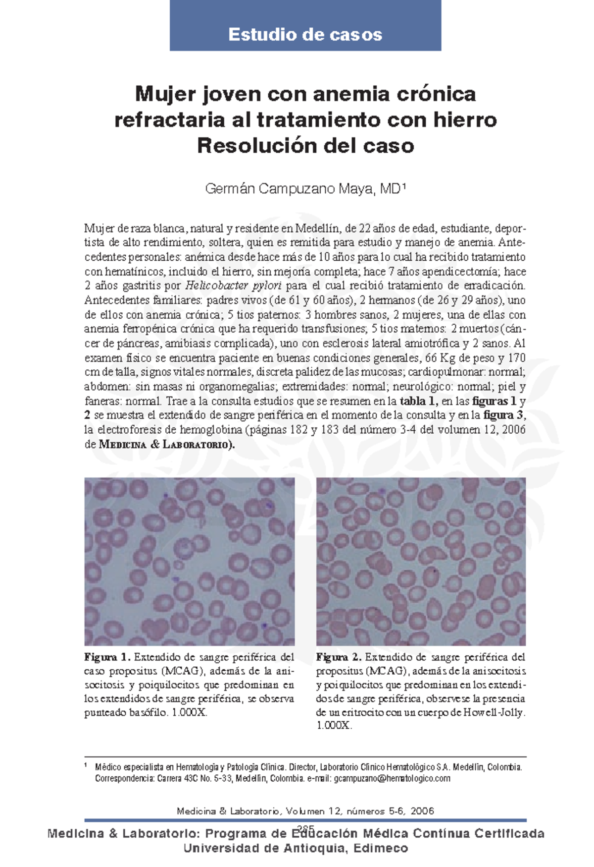 Dialnet-Mujer Joven Con Anemia Cronica Refractaria Al Tratamiento ...