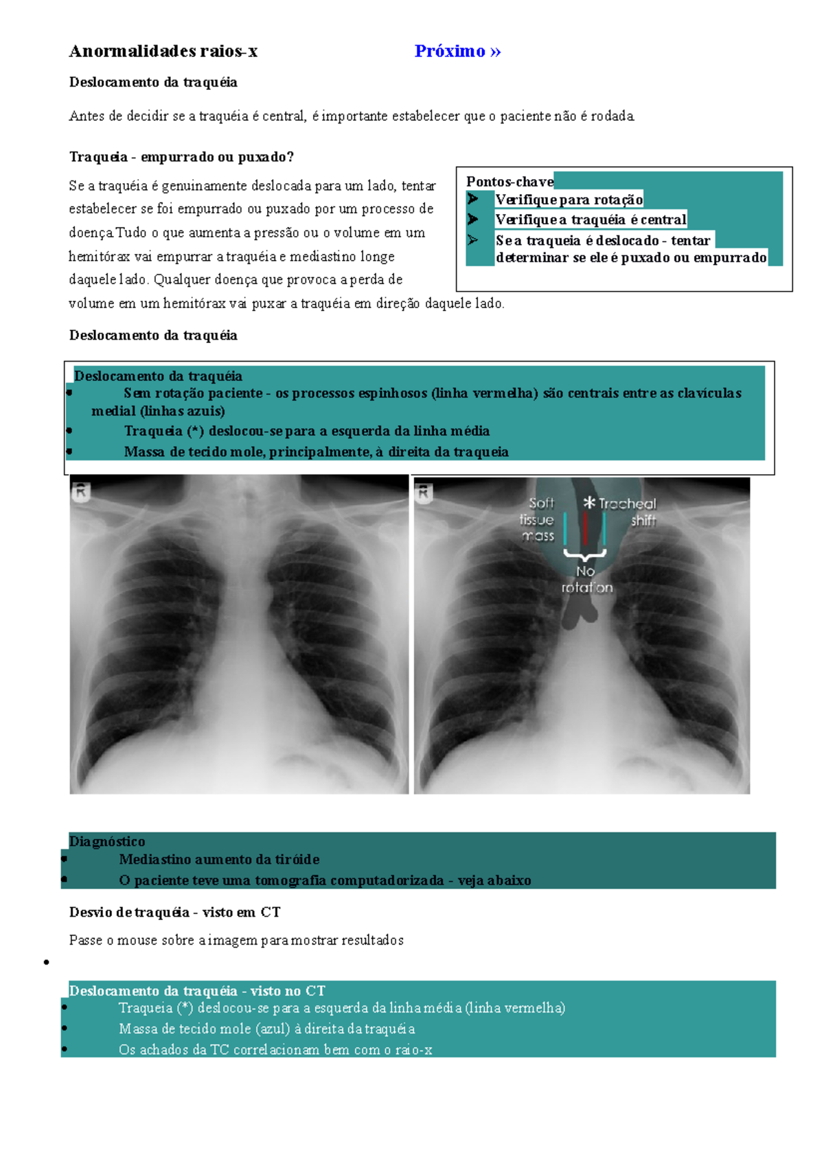 Rx torax - Aula - Anormalidades raios-x«AnteriorTutoriaisPróximo ...