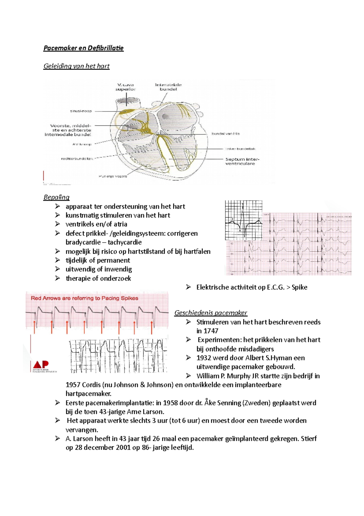 Pacemaker en Defibrillatie samenvatting - Pacemaker en Defibrillatie ...