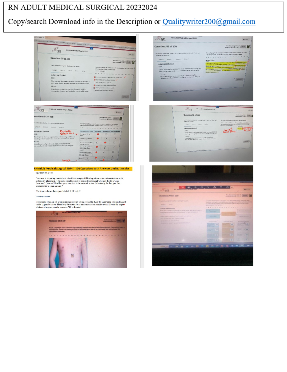 All RN 2024 Adult Medical Surgical Ati Proctored Exam With 70 NGN ...