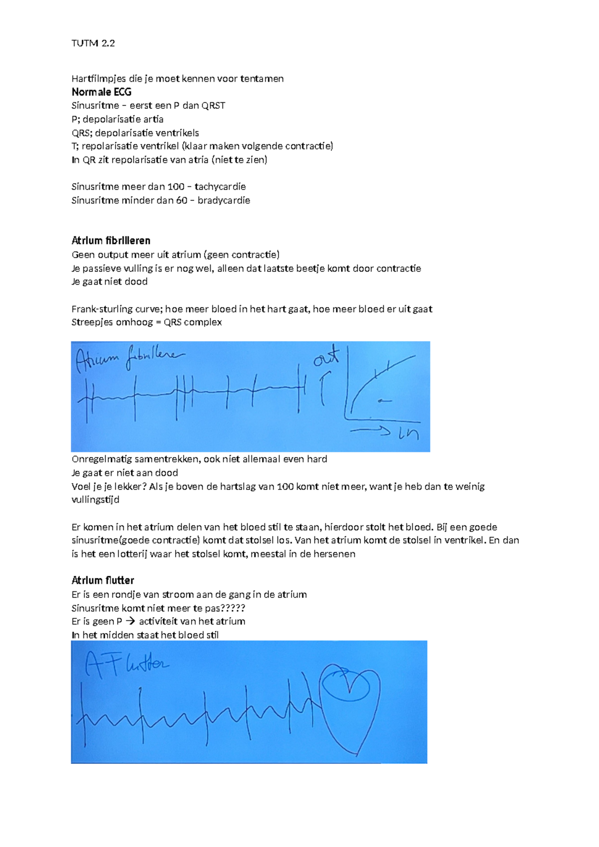 Hartfilmpjes die je moet kennen voor tentamen - TUTM 2. Hartfilmpjes ...