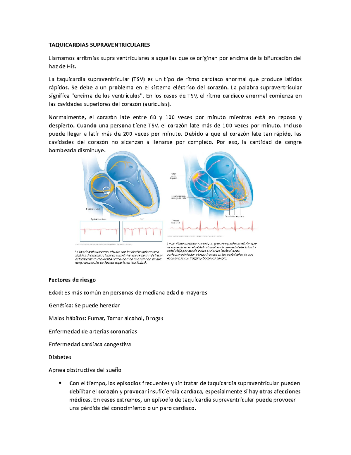 Taquicardias Supraventriculares - TAQUICARDIAS SUPRAVENTRICULARES ...