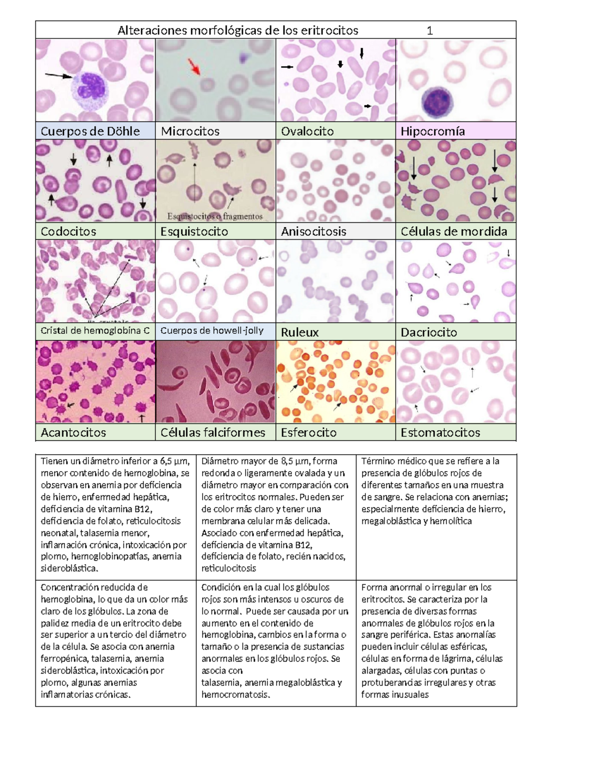 Alteraciones morfológicas Loteria - Cuerpos de Döhle Microcitos ...
