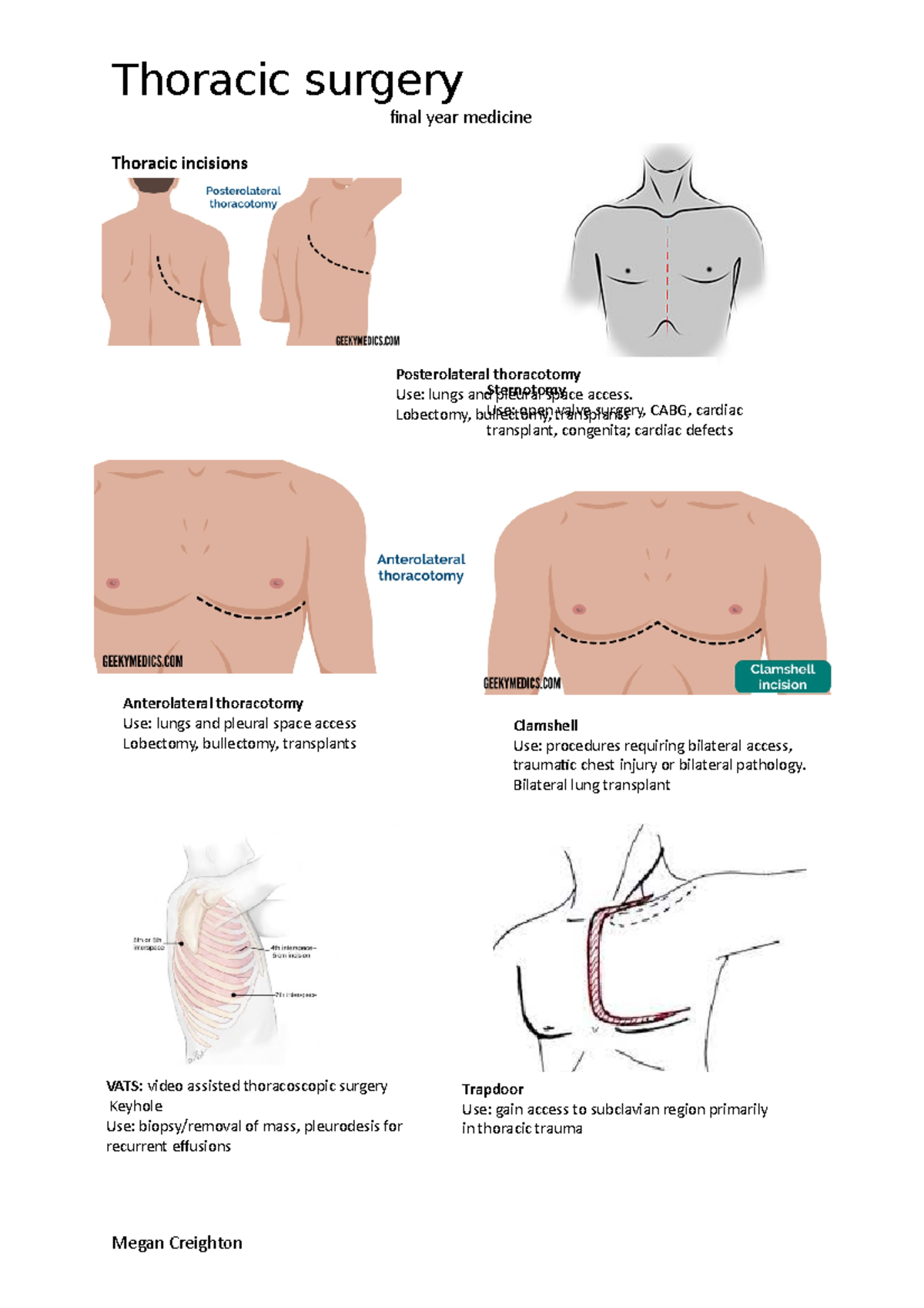 Clamshell Incision