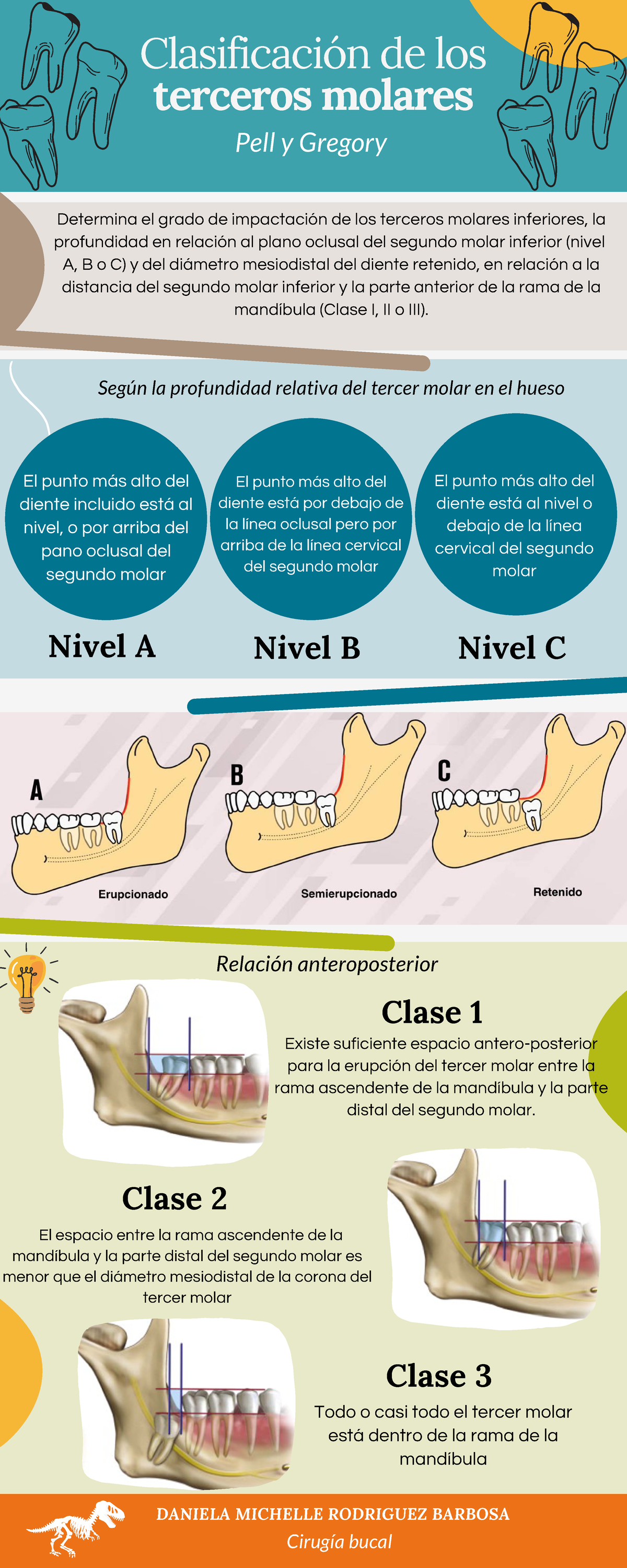 Clasificación Pell y Gregory - Clase 3 Según la profundidad relativa ...