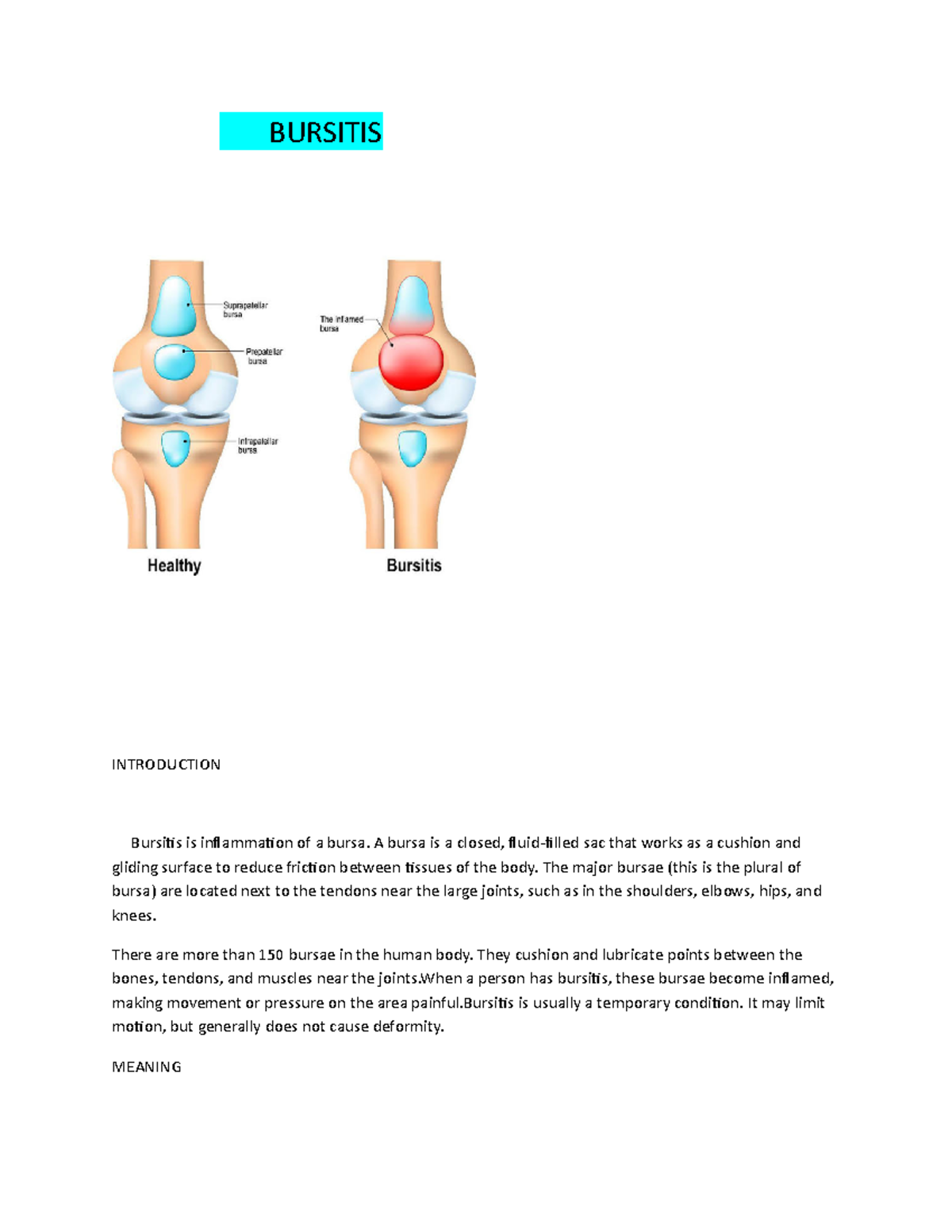 Bursitis-WPS Office - Lecture notes - BURSITIS INTRODUCTION Bursitis is ...