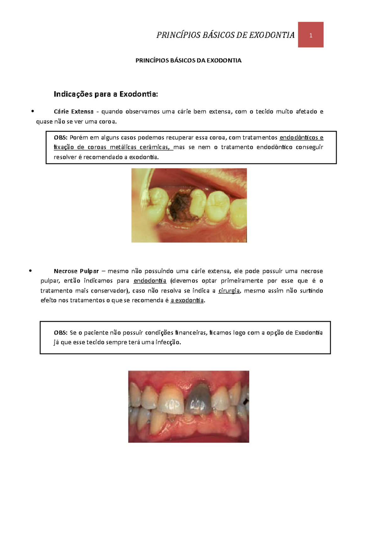 3 Princípios básicos da Exodontia - DE EXODONTIA 1 DA EXODONTIA para a ...