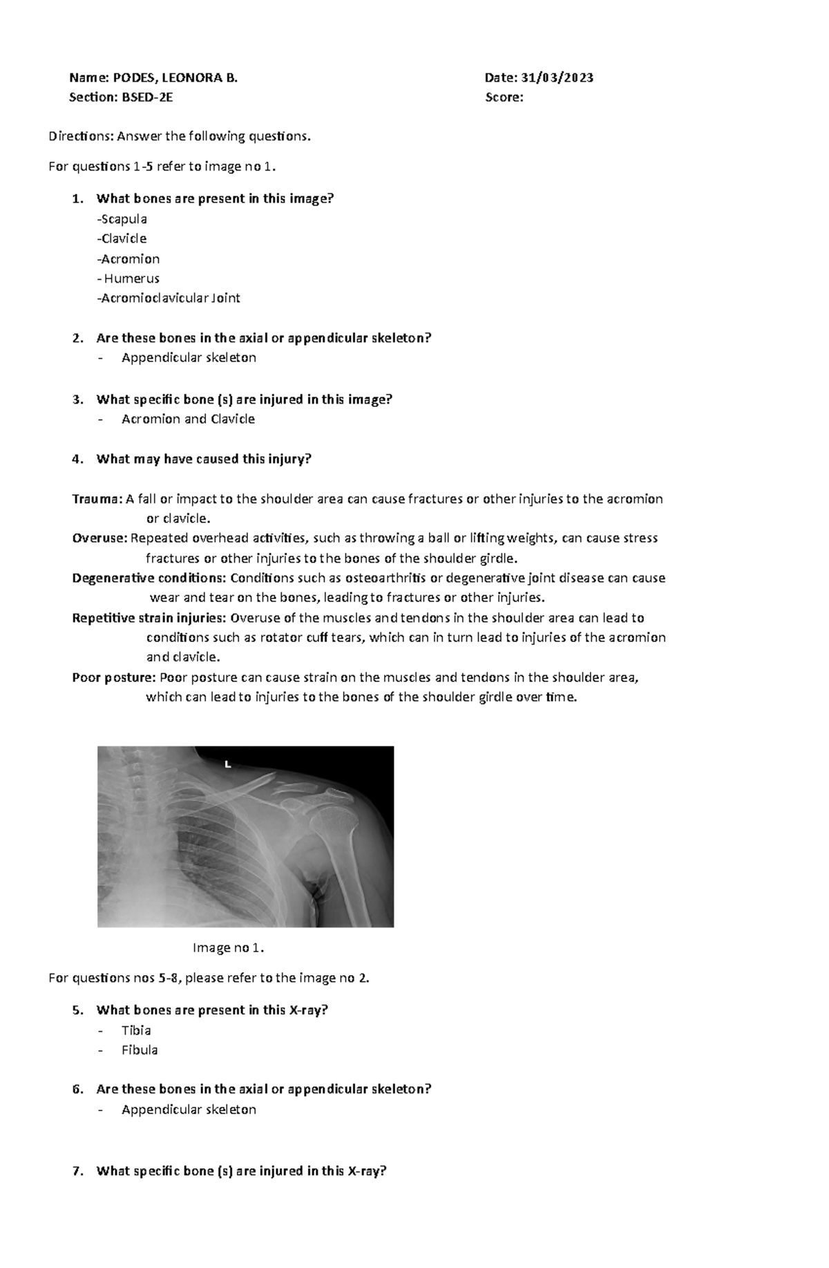 \ Anaphy Activity (Appendicular Skeleton) - Name: PODES, LEONORA B ...