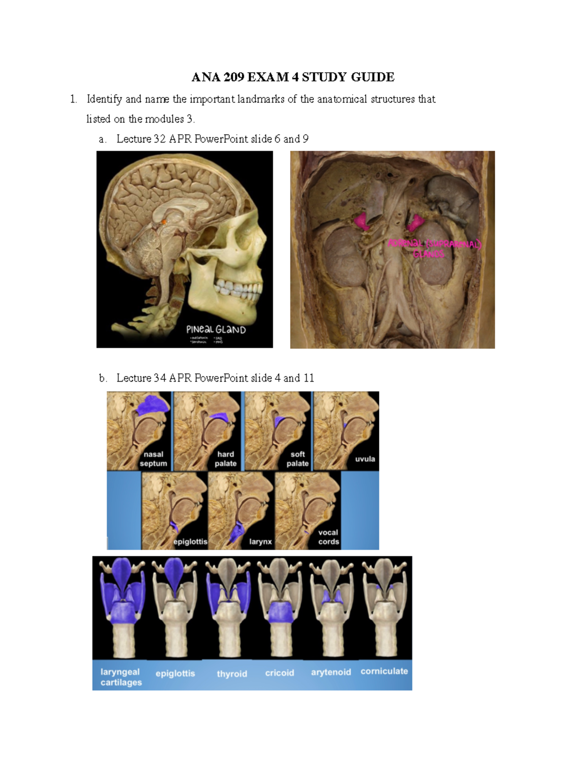 ANA 209 EXAM 4 Study Guide - ANA 209 EXAM 4 STUDY GUIDE Identify and ...