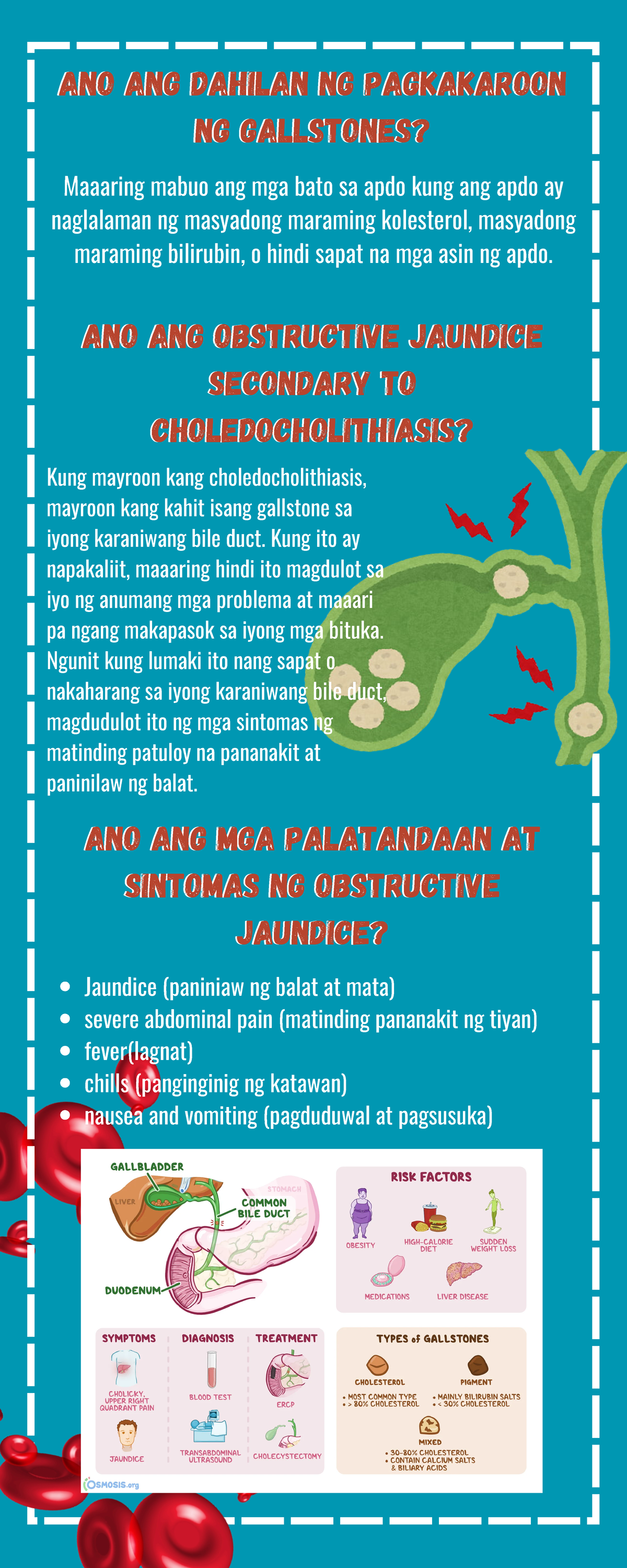 Gallstones - kajdAFKJHHa - ano ang dahilan ng pagkakaroon ng gallstones ...