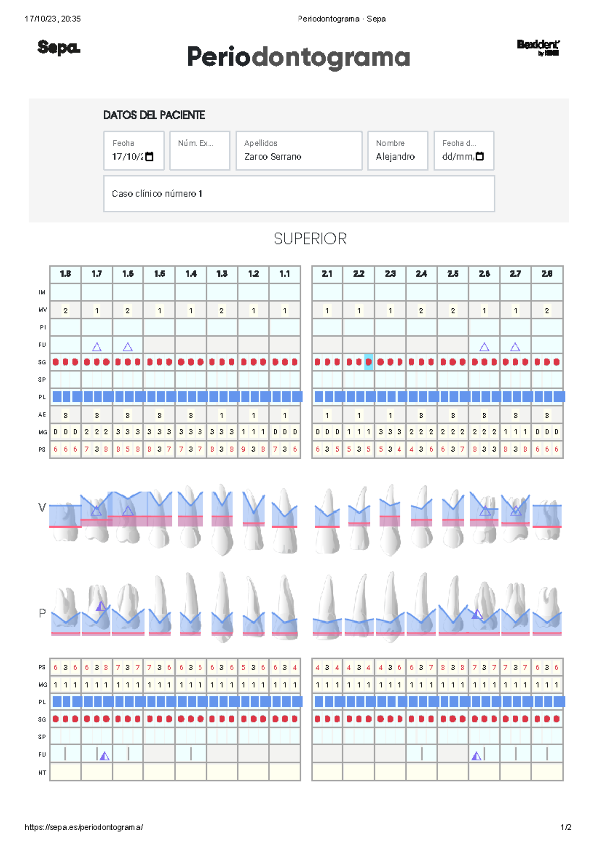 Periodontograma · Sepa 1 - 17/10/23, 20:35 Periodontograma · Sepa sepa ...