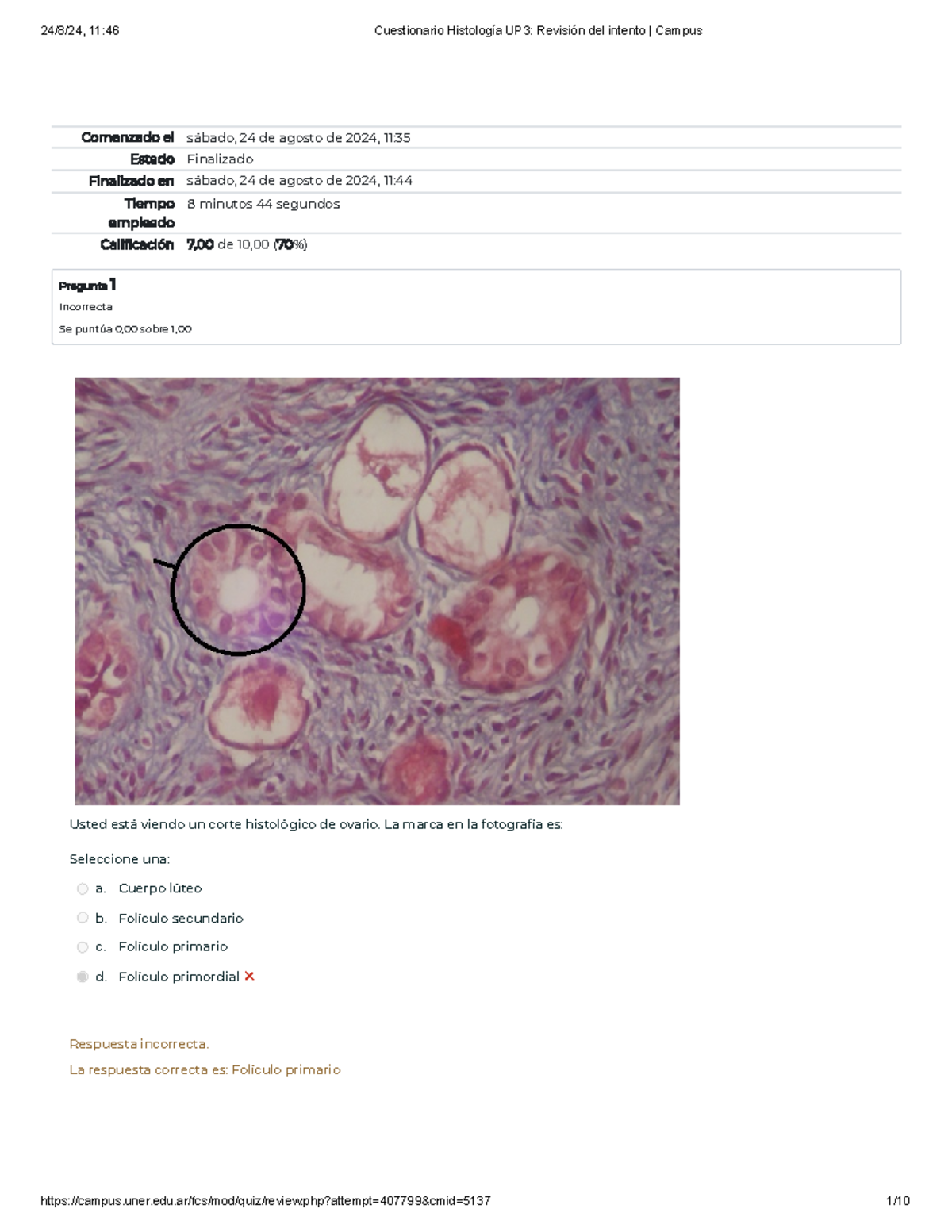 Cuestionario Histología UP3 Revisión del intento Campus - Comenzado el sábado, 24 de agosto de ...