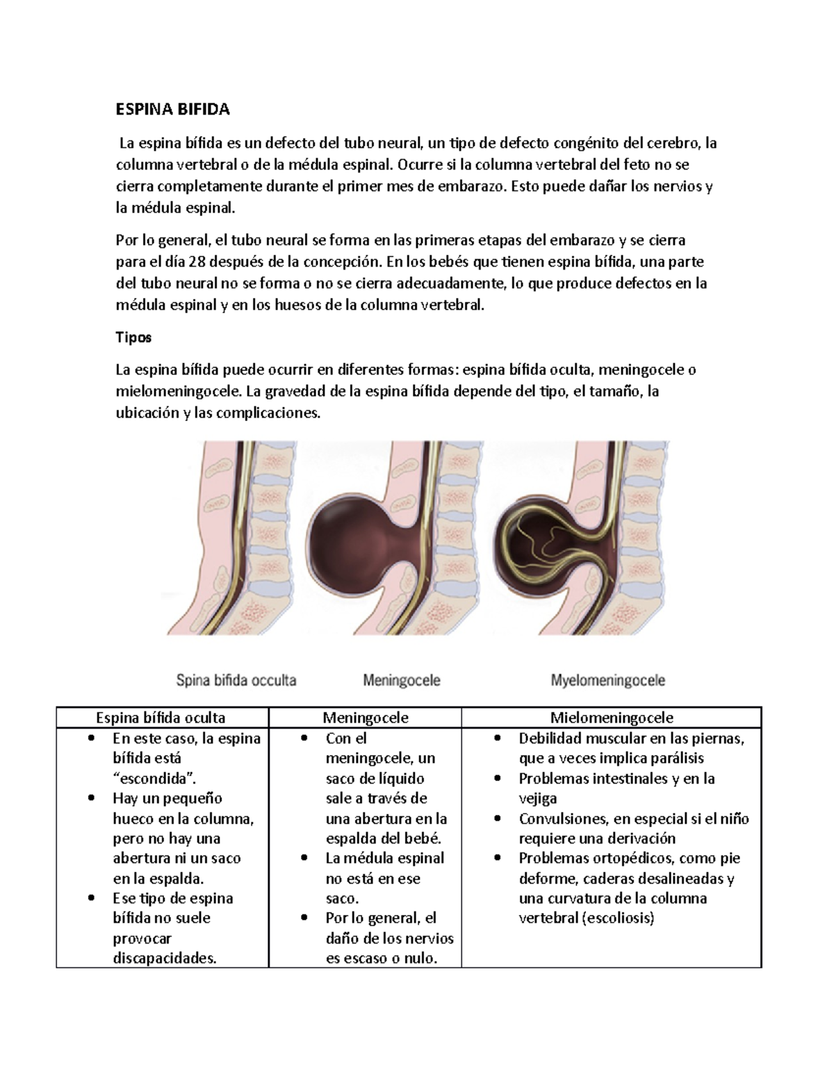 Enfermedades Congenitas - ESPINA BIFIDA La espina es un defecto del ...