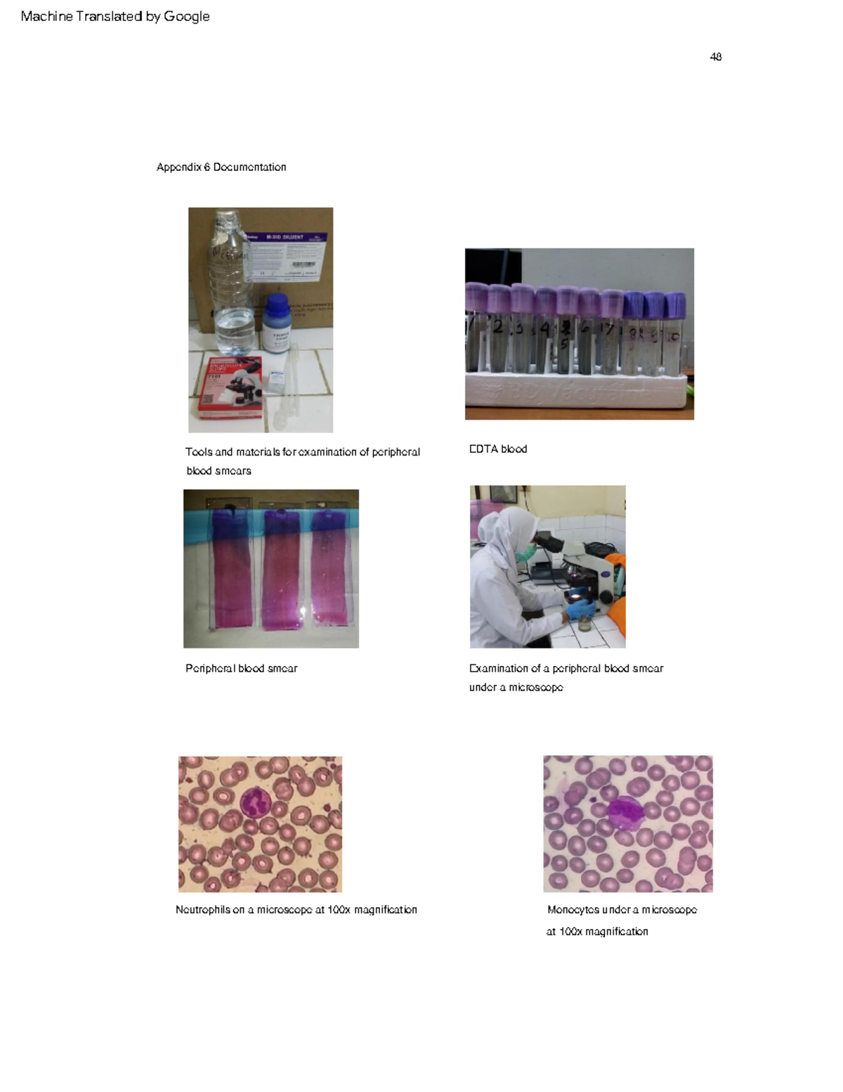 Theory of nursing-88 - Peripheral blood smear 48 EDTA blood Monocytes ...