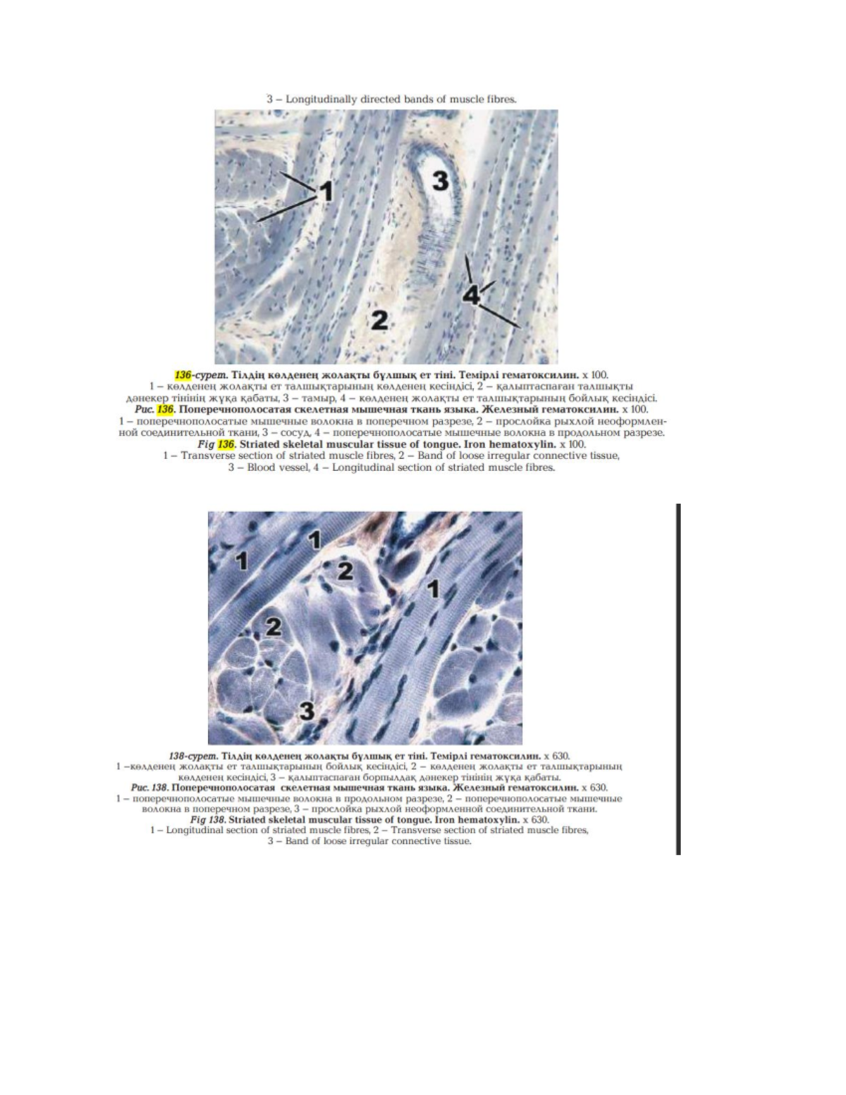 Histology final specimen - 3 Longitudinally directed bands of muscle ...