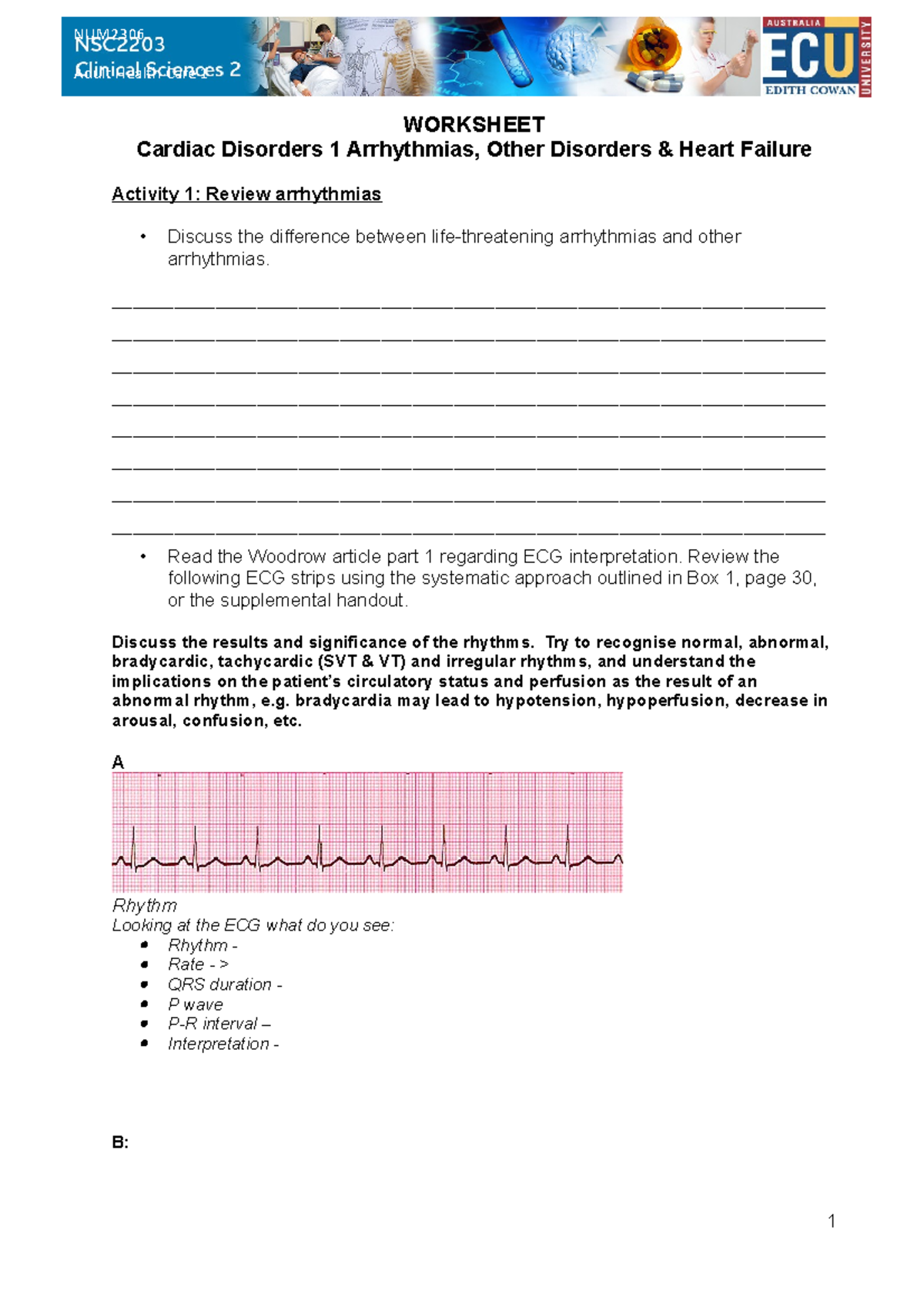 Cardiac Disorders Part 2 Arrhythmias Heart Failure Worksheet 2021-1-1 ...