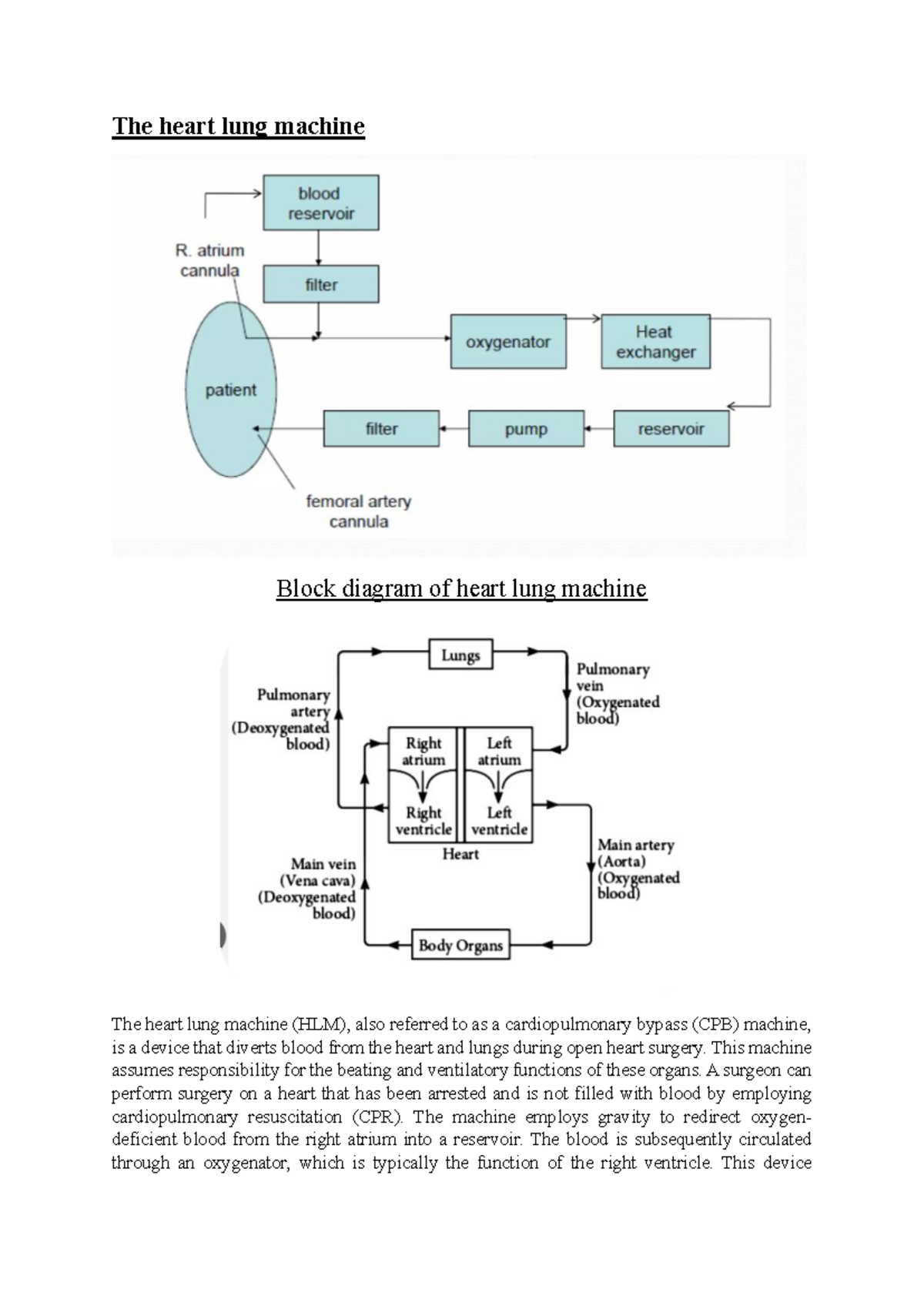 Heart Lung Machine - The heart lung machine Block diagram of heart lung ...