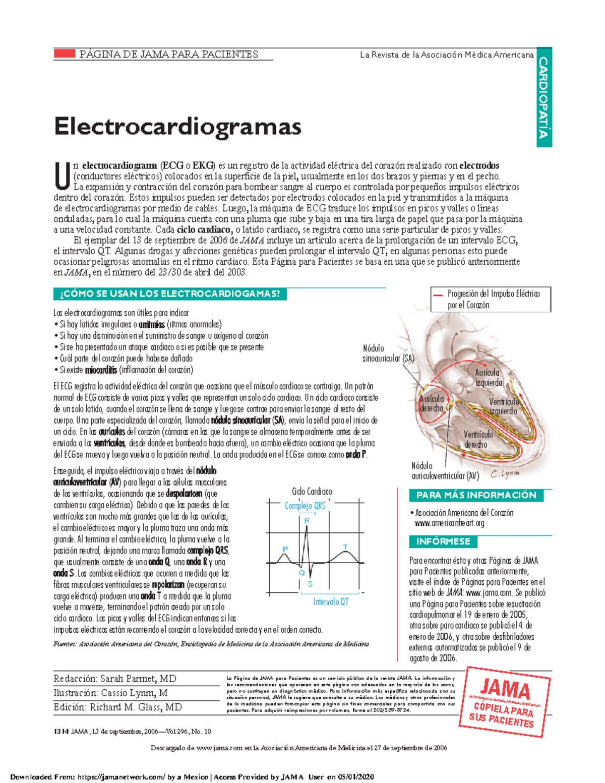 Electro - ejemplo de un EKG - Redacción: Sarah Parmet, MD Ilustración ...