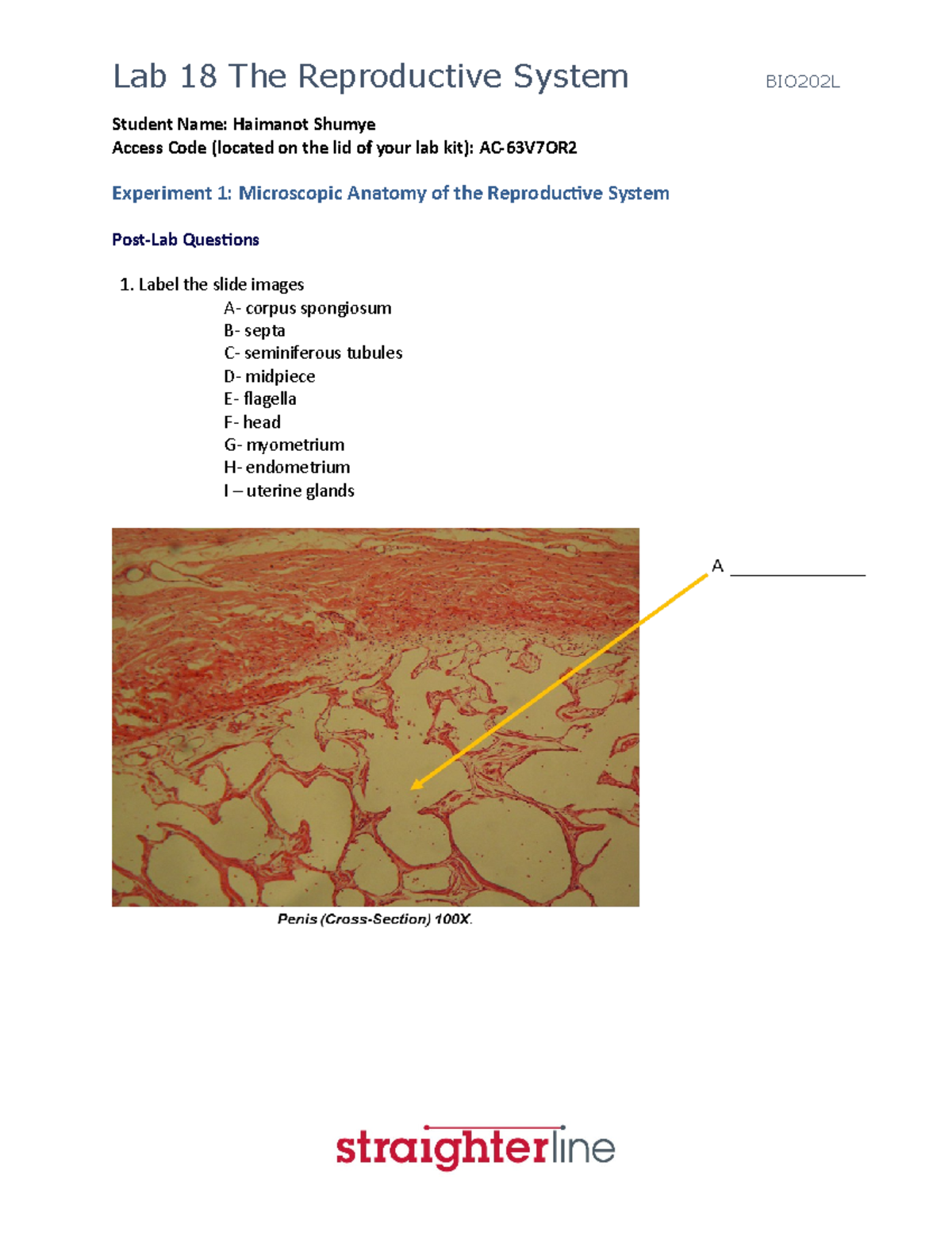 Reproductive System - lab report - Student Name: Haimanot Shumye Access ...