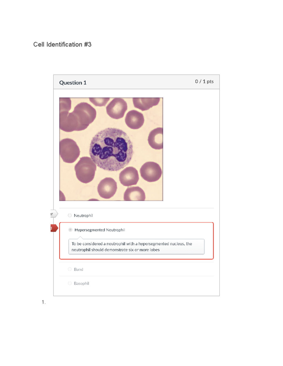 Hematology cell identification - Cell Identification # Discussion(s) 1 ...