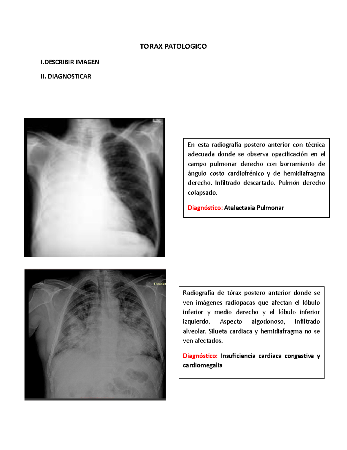 1.5 Torax Patologico - Descripción de imágenes - TORAX PATOLOGICO I ...