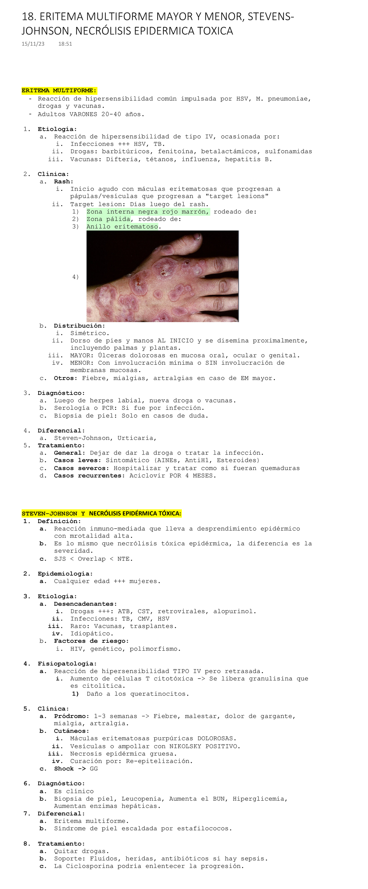 18. Eritema Multiforme Mayor Y Menor, Stevens- Johnson, Necró Lisis ...