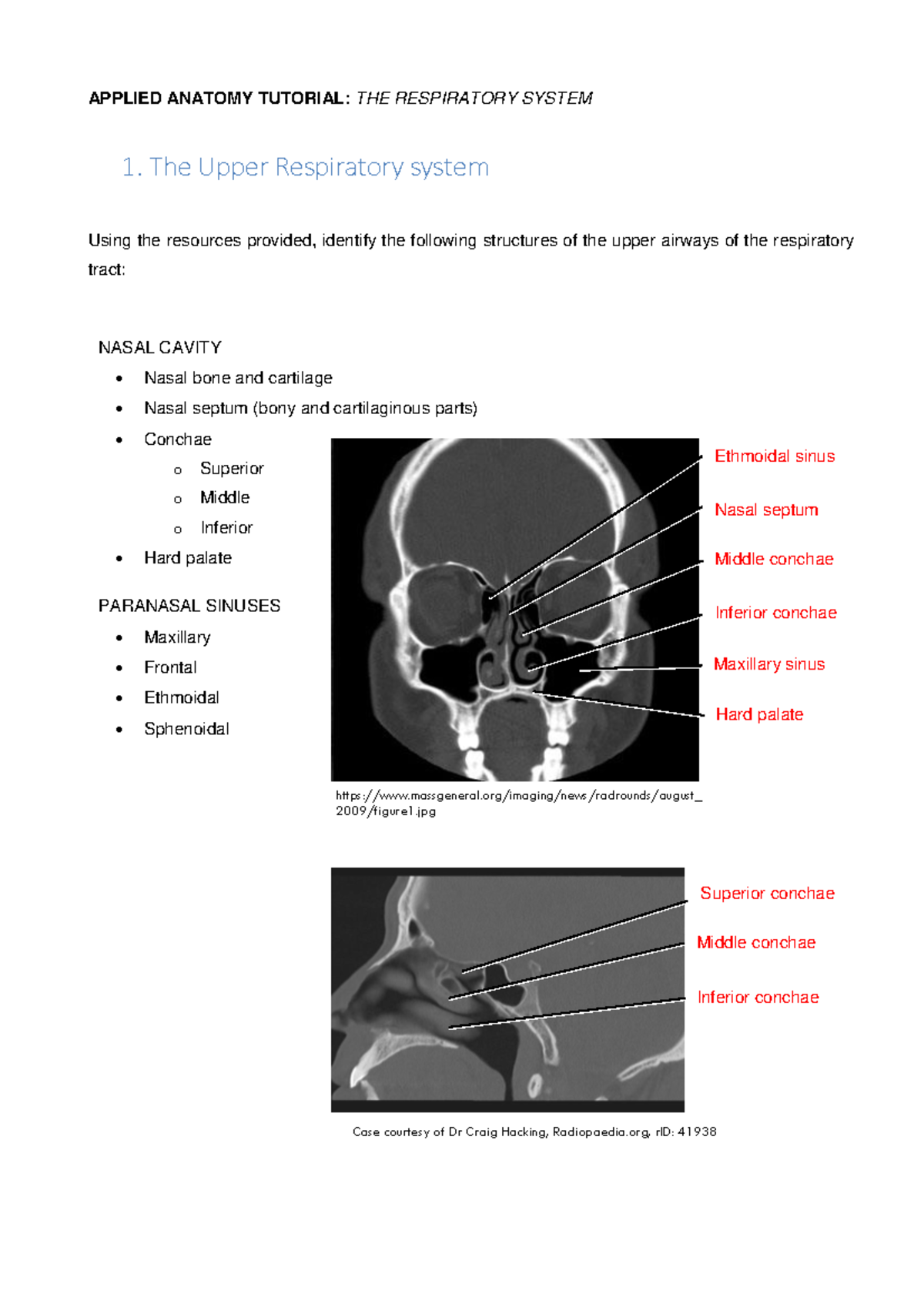 Tutorial Answers - APPLIED ANATOMY TUTORIAL: THE RESPIRATORY SYSTEM 1 ...