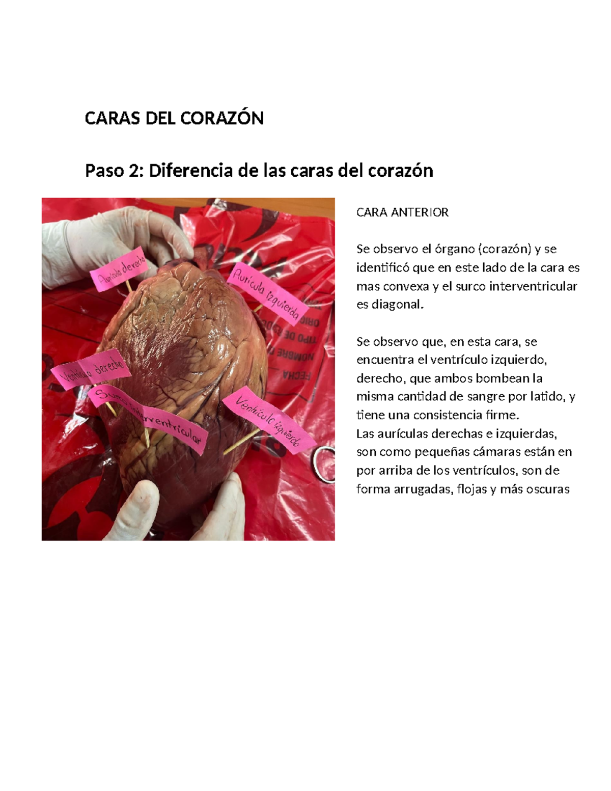 Caras DEL Corazón - CARAS DEL CORAZÓN Paso 2: Diferencia de las caras ...