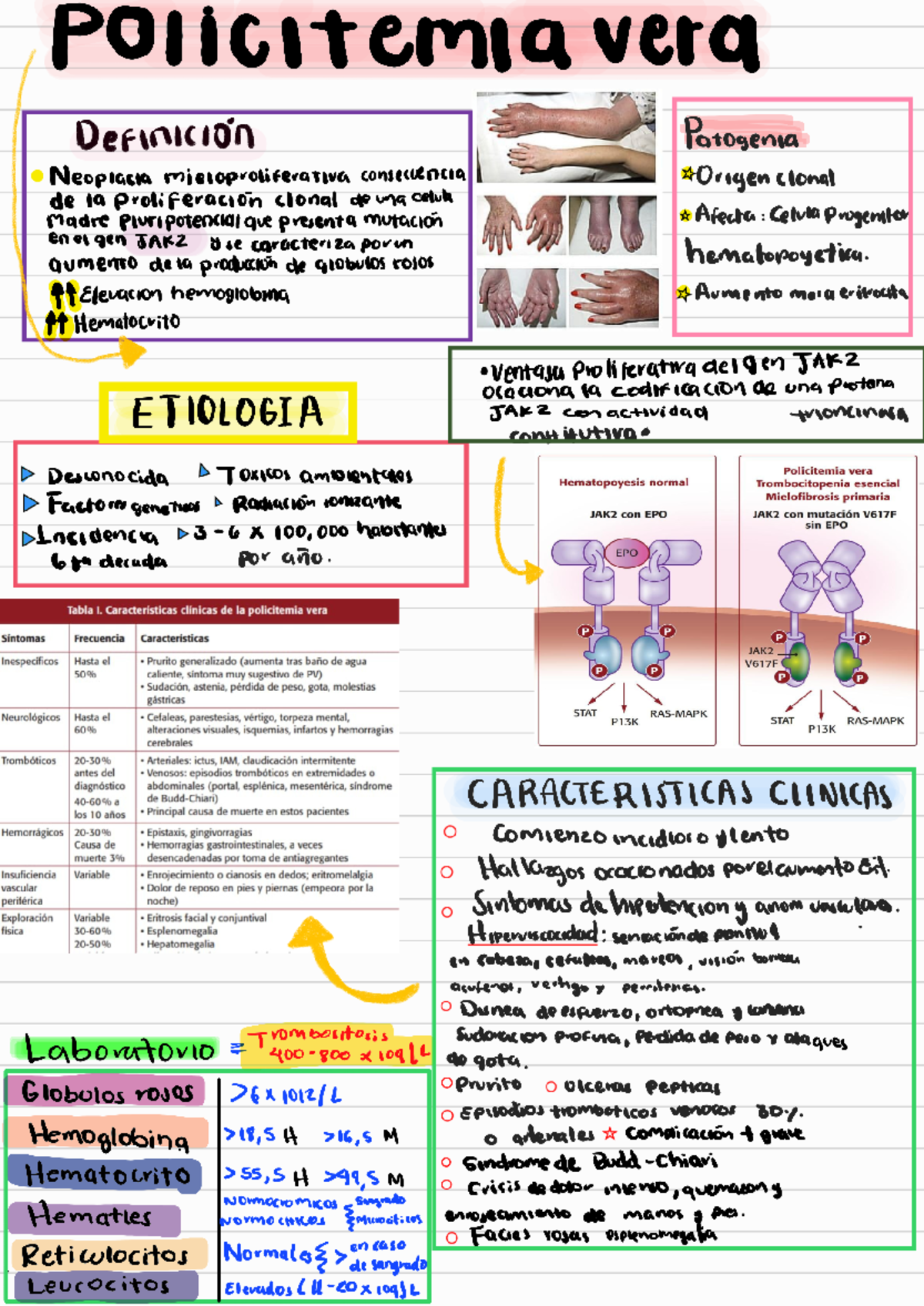 Policitemia vera - Policitema verá, mapa conceptual con todos los ...