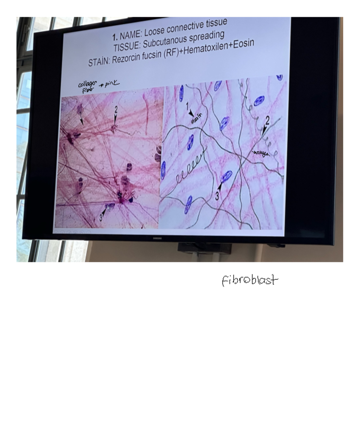 Lab Connective Tissue - Histology 1st year 23-24 - collage - p!nk F!ber ...