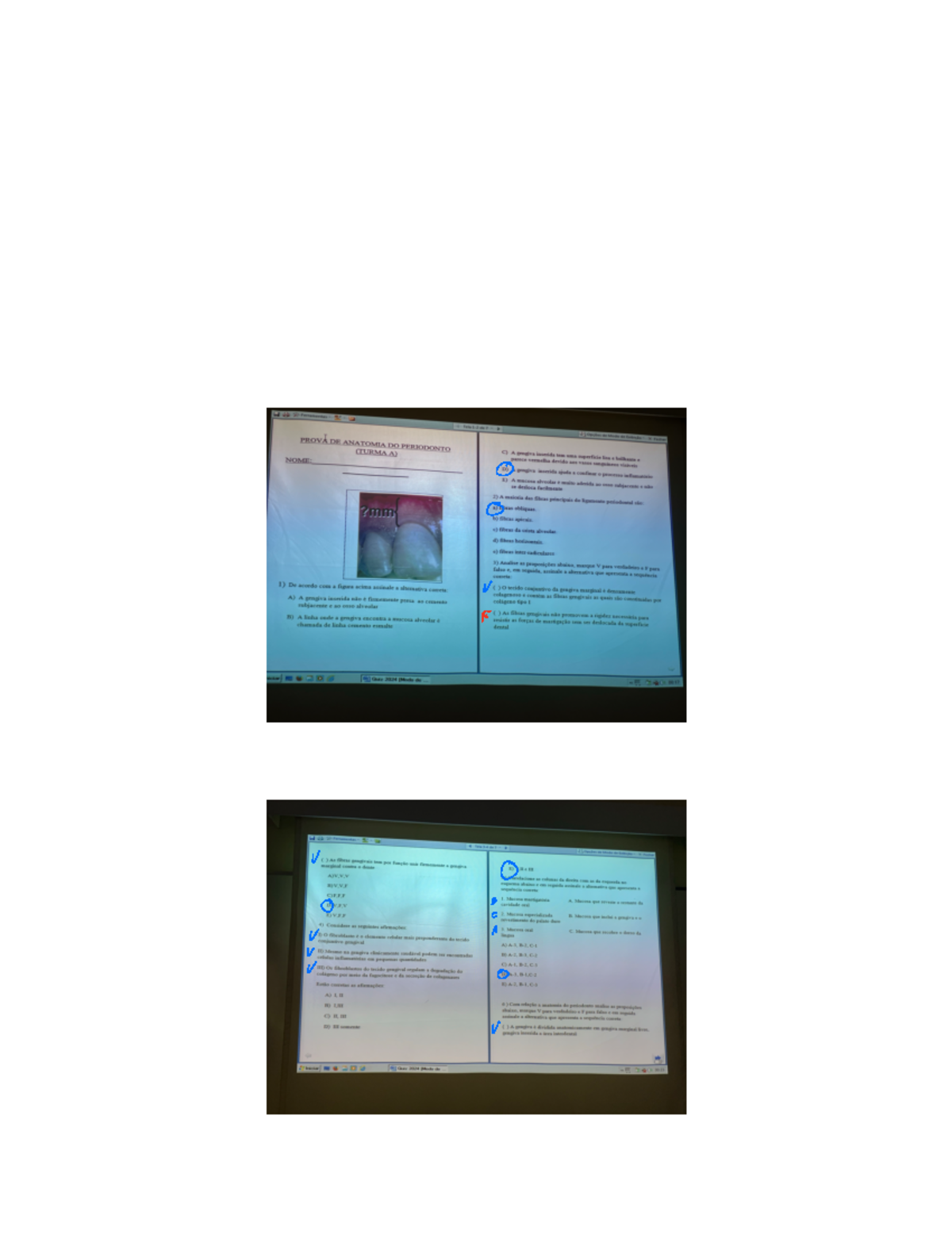 tarefa de aprendizado - H PROVA DE ANATOMIA DO PERIODONTO C) A gengiva ...