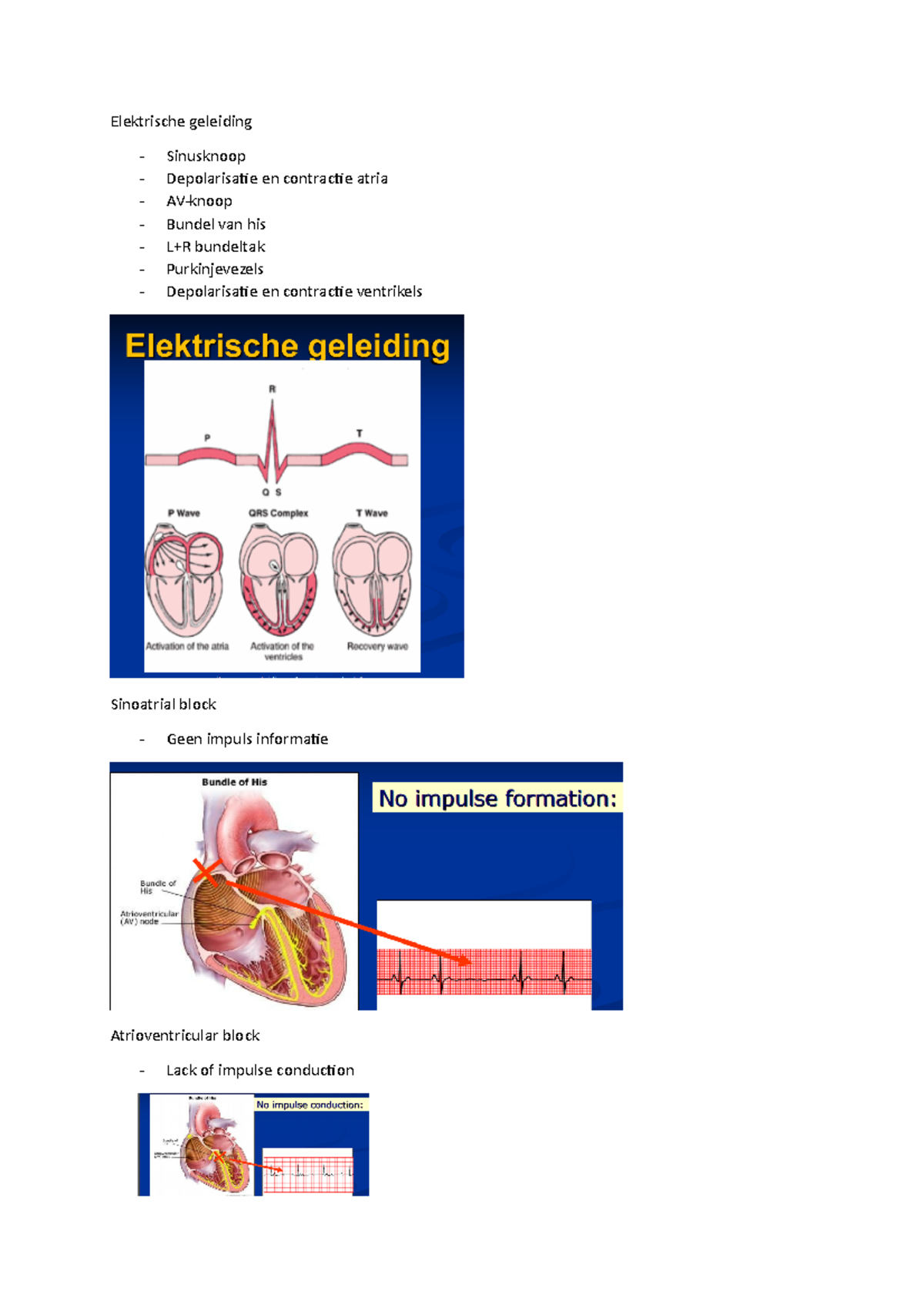HC Ritme- en geleidingsstoornissen - Elektrische geleiding - Sinusknoop ...