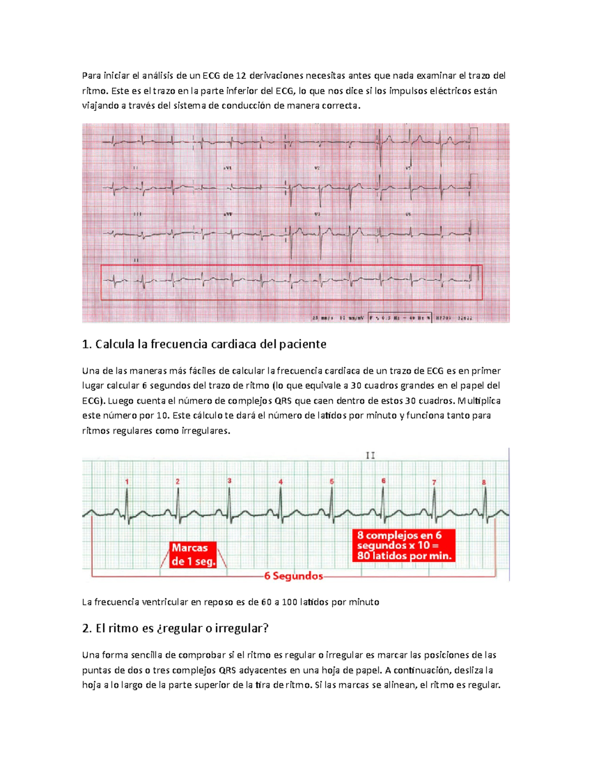 Analisis facil del ekg 2 - Para iniciar el análisis de un ECG de 12 ...