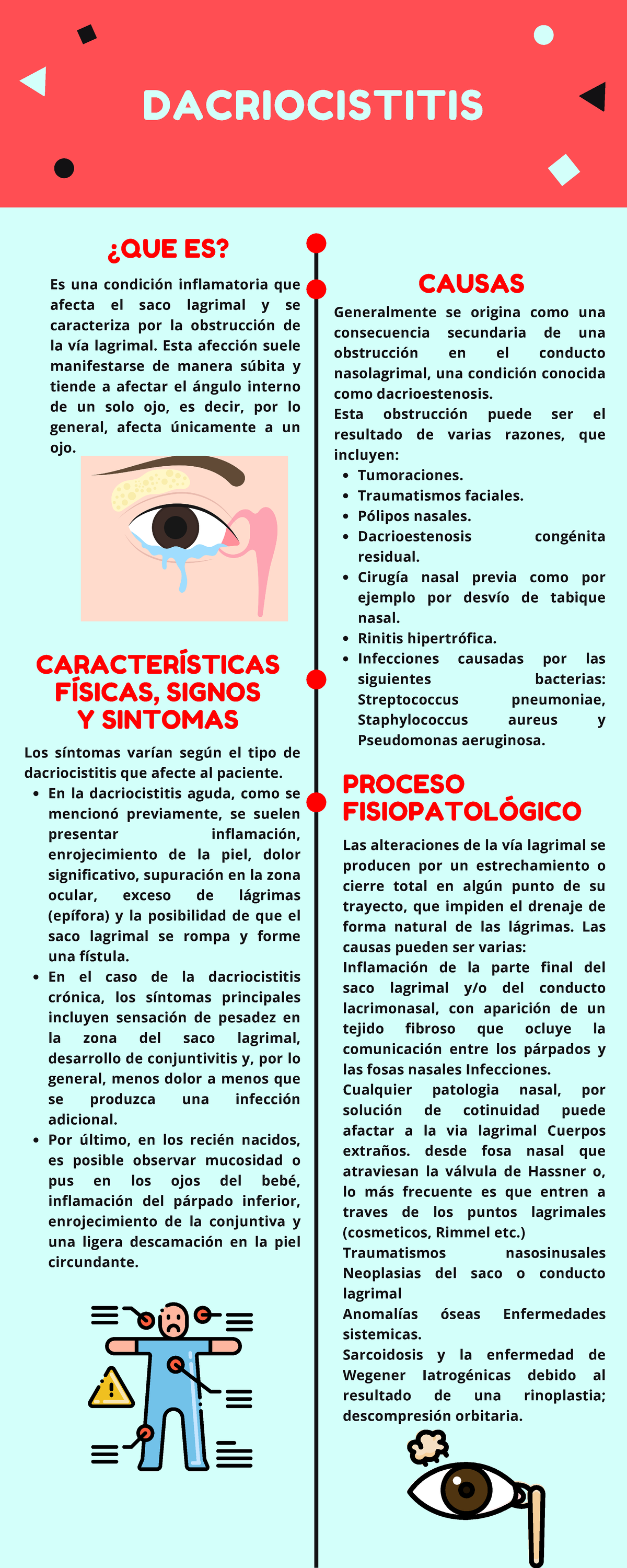 Dacriocistitis - Patología ocular. Es una condición inflamatoria que ...