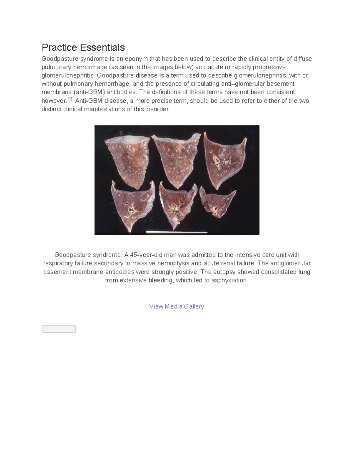Practice Essentials - Practice Essentials Goodpasture syndrome is an eponym that has been used ...