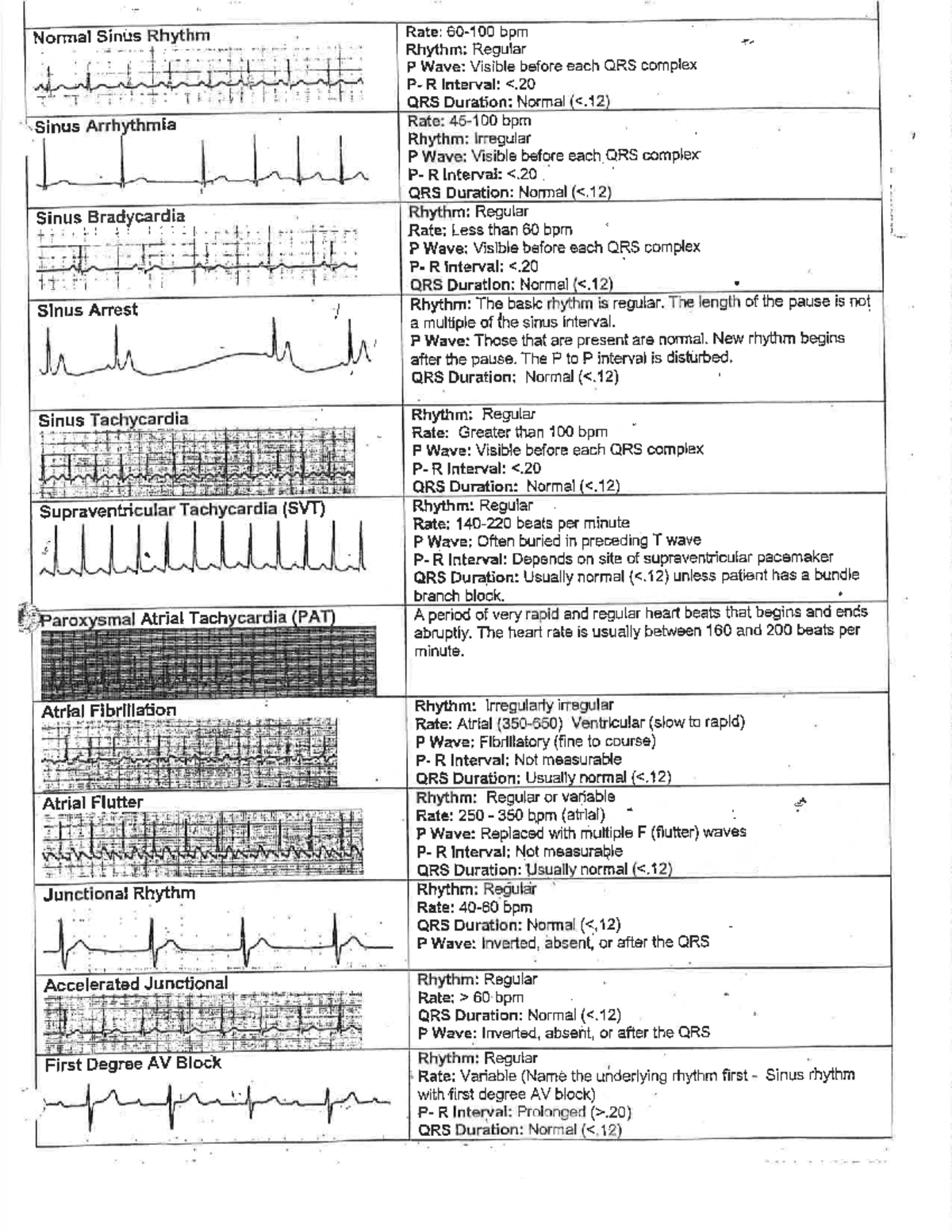 EKG reference sheet - EKG - nurs326 - Studocu