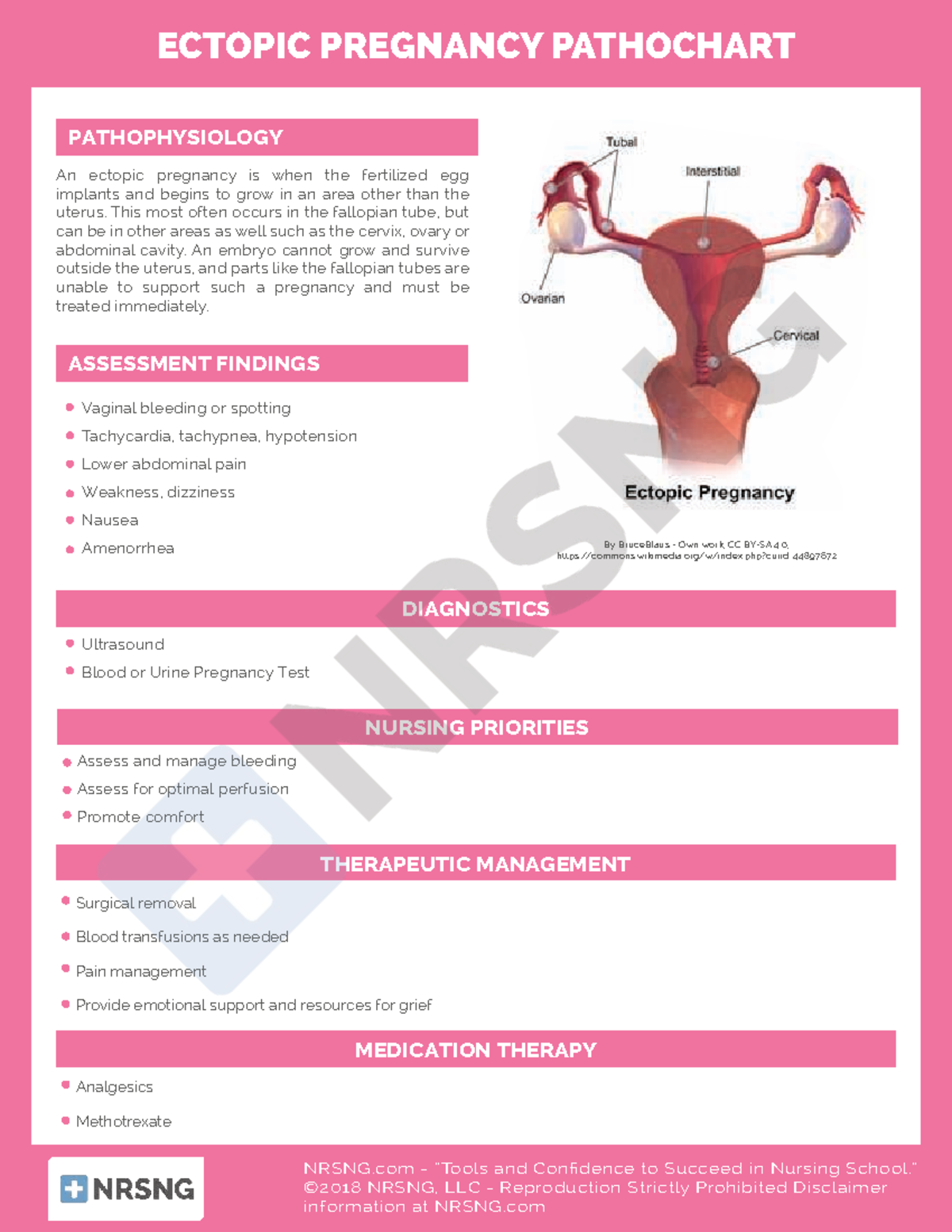 Cs-ob-008-ectopic pregnancy pathochart - ECTOPIC PREGNANCY PATHOCHART ...