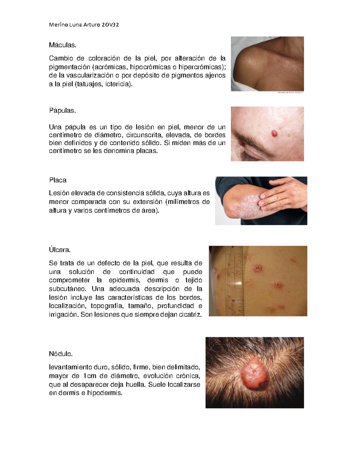 Lesiones Primarias - Merino Luna Arturo 2OV Máculas. Cambio de ...