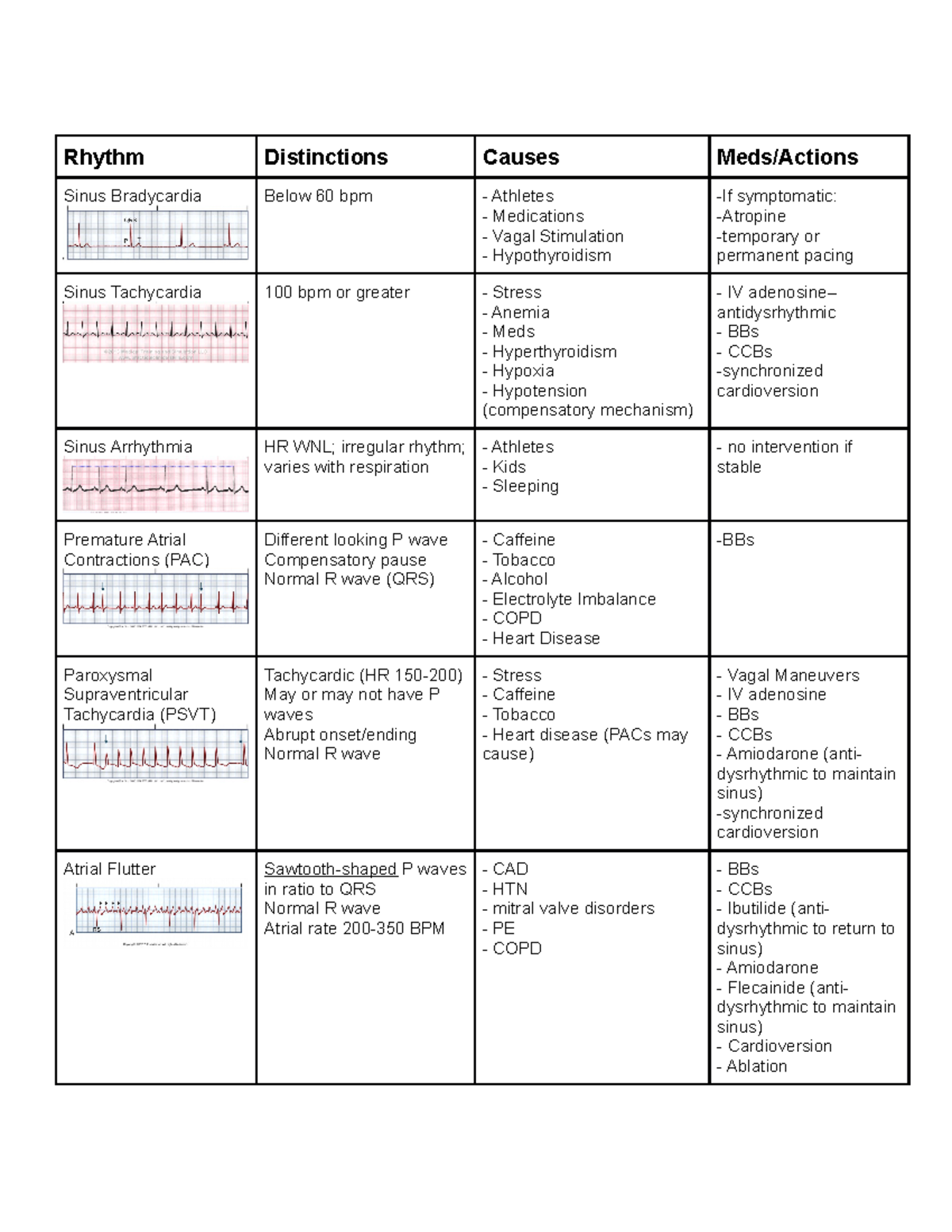 EKG Chart - study guide - Rhythm Distinctions Causes Meds/Actions Sinus ...