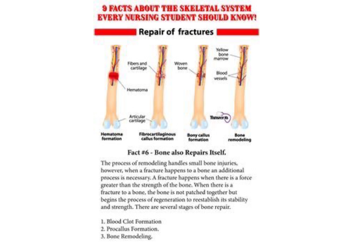 Learning with anatomy - SS Repair of fractures Fact Bone also Repairs ...