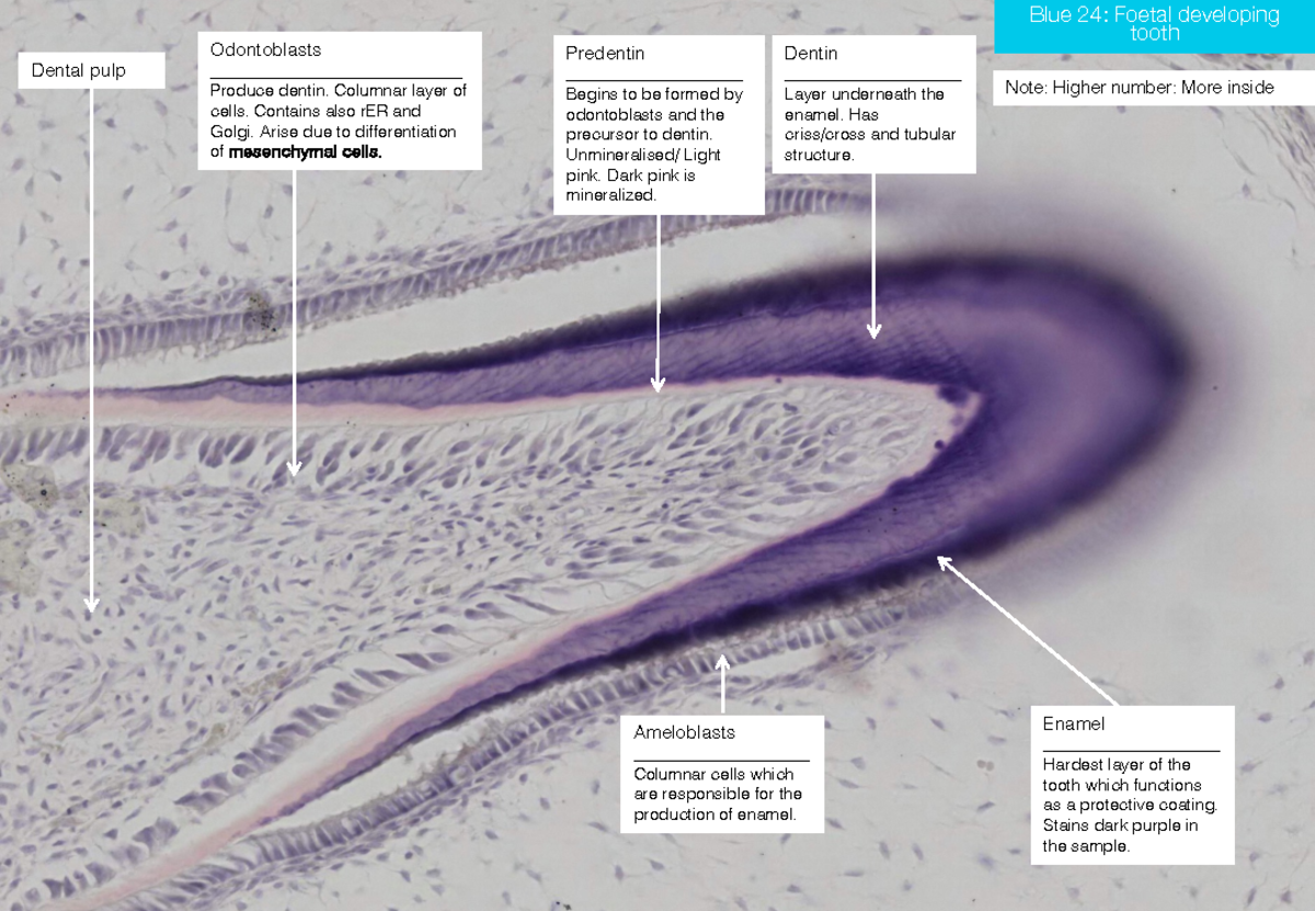 Tooth Histology Slides