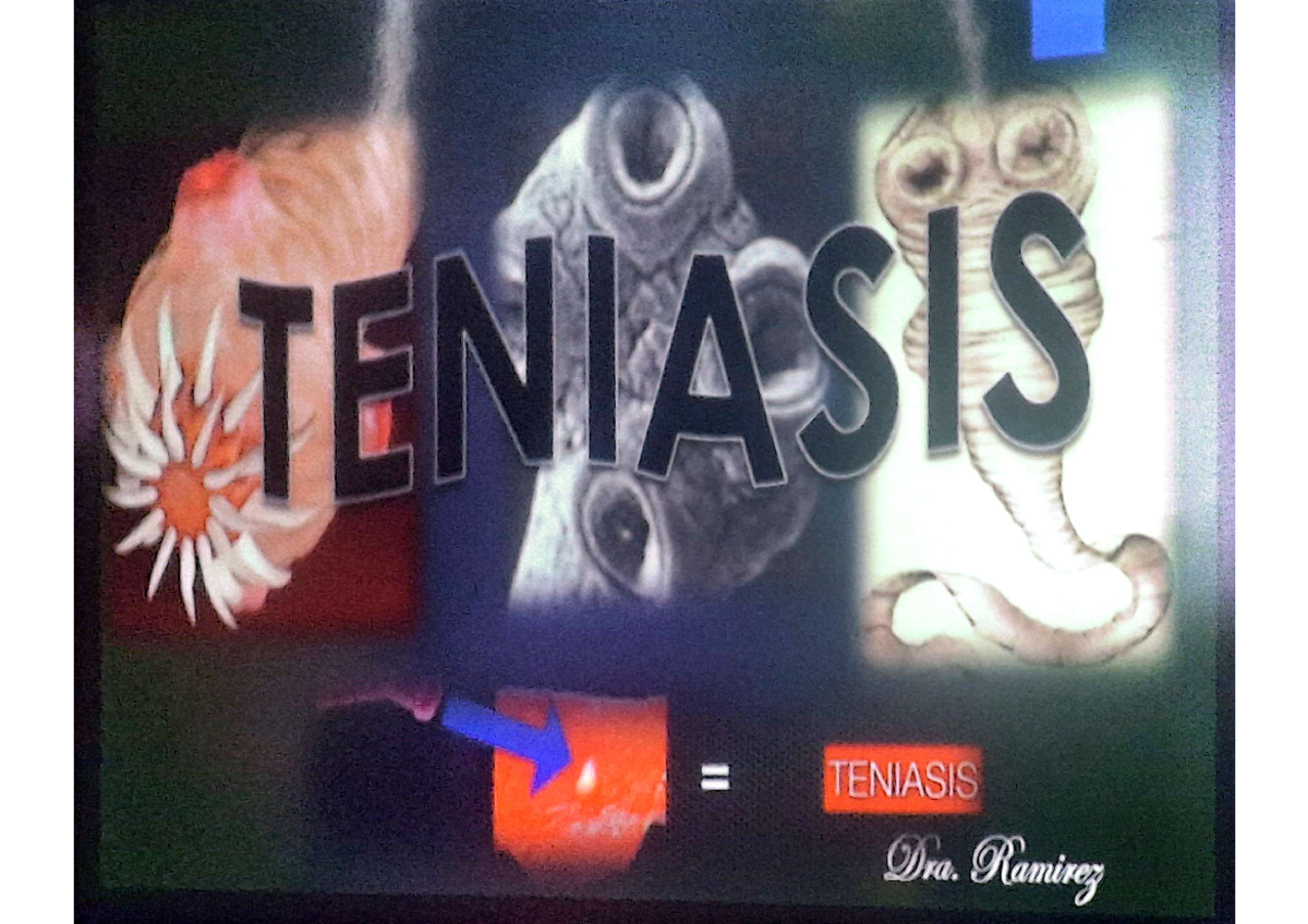 Teniasis - Documentos de Parasitología - TENIASIS 1 SAGINATA PECIE: 1 ...
