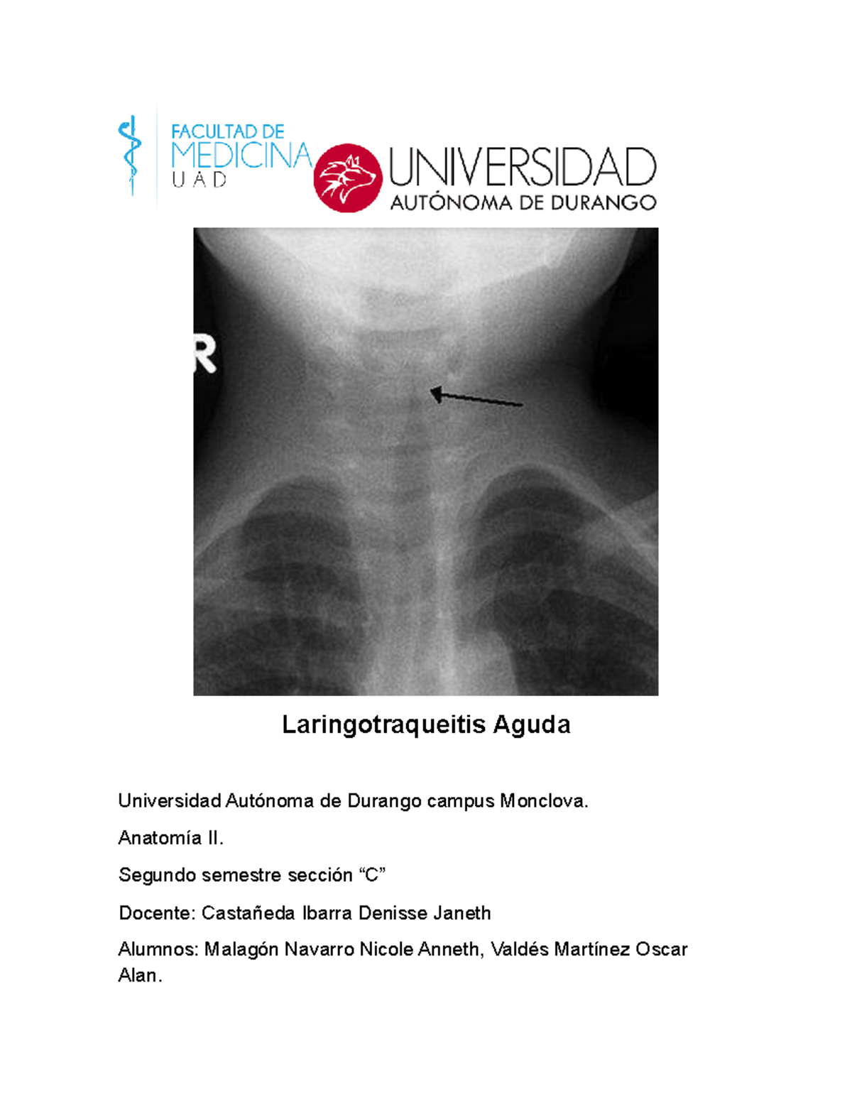 Investigación anatomía II - Laringotraqueitis Aguda Universidad ...
