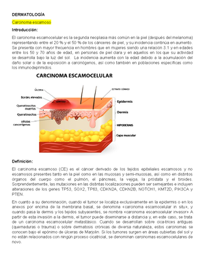 Dermatofitosis - LOCALIZACIÓN Y MORFOLOGÍA - QUE ES Son micosis ...