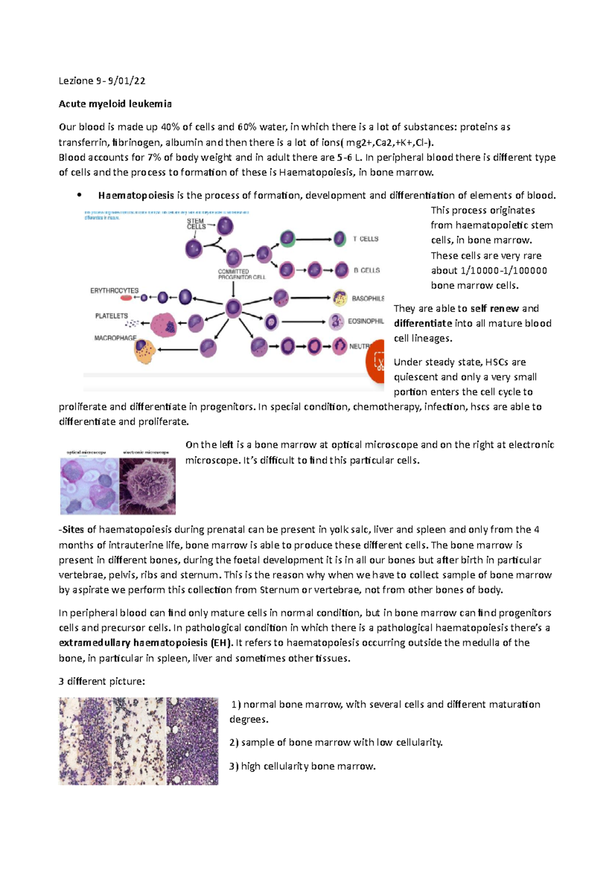 Acute myeloid leukemias - Lezione 9- 9/01/ Acute myeloid leukemia Our blood is made up 40% of ...