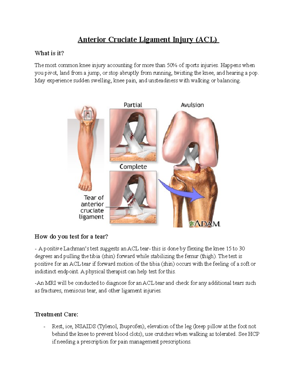 Anterior Cruciate Ligament Injury - Happens when you pivot, land from a ...