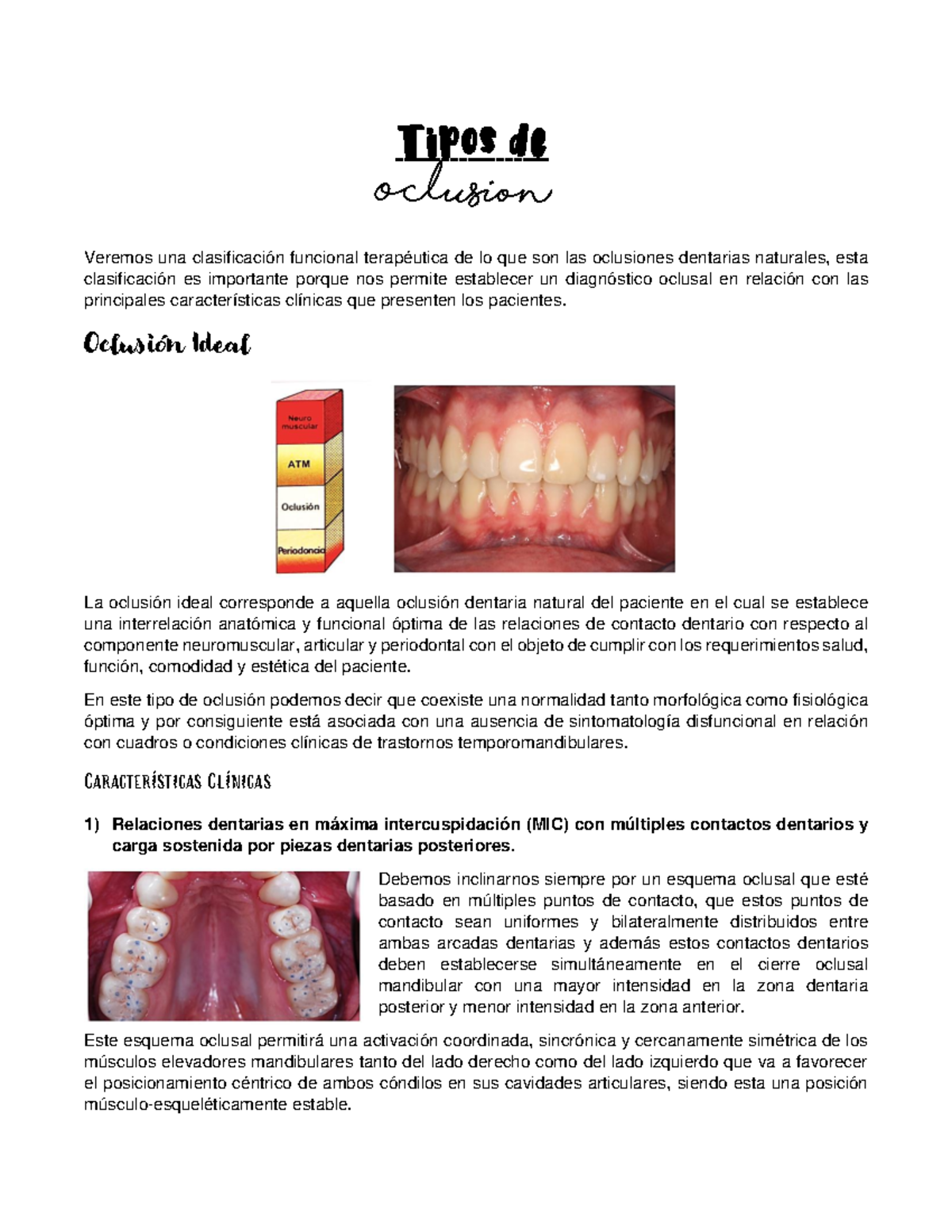 Tipos de Oclusión - resumen de apoyo rápido - Veremos una clasificación ...