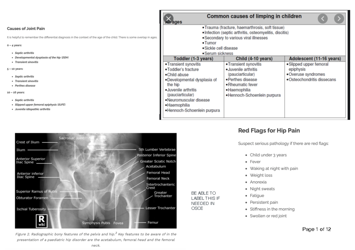 Limping Child OSCE - BE ABLE TO LABEL THIS IF NEEDED IN OSCE About 1 or ...