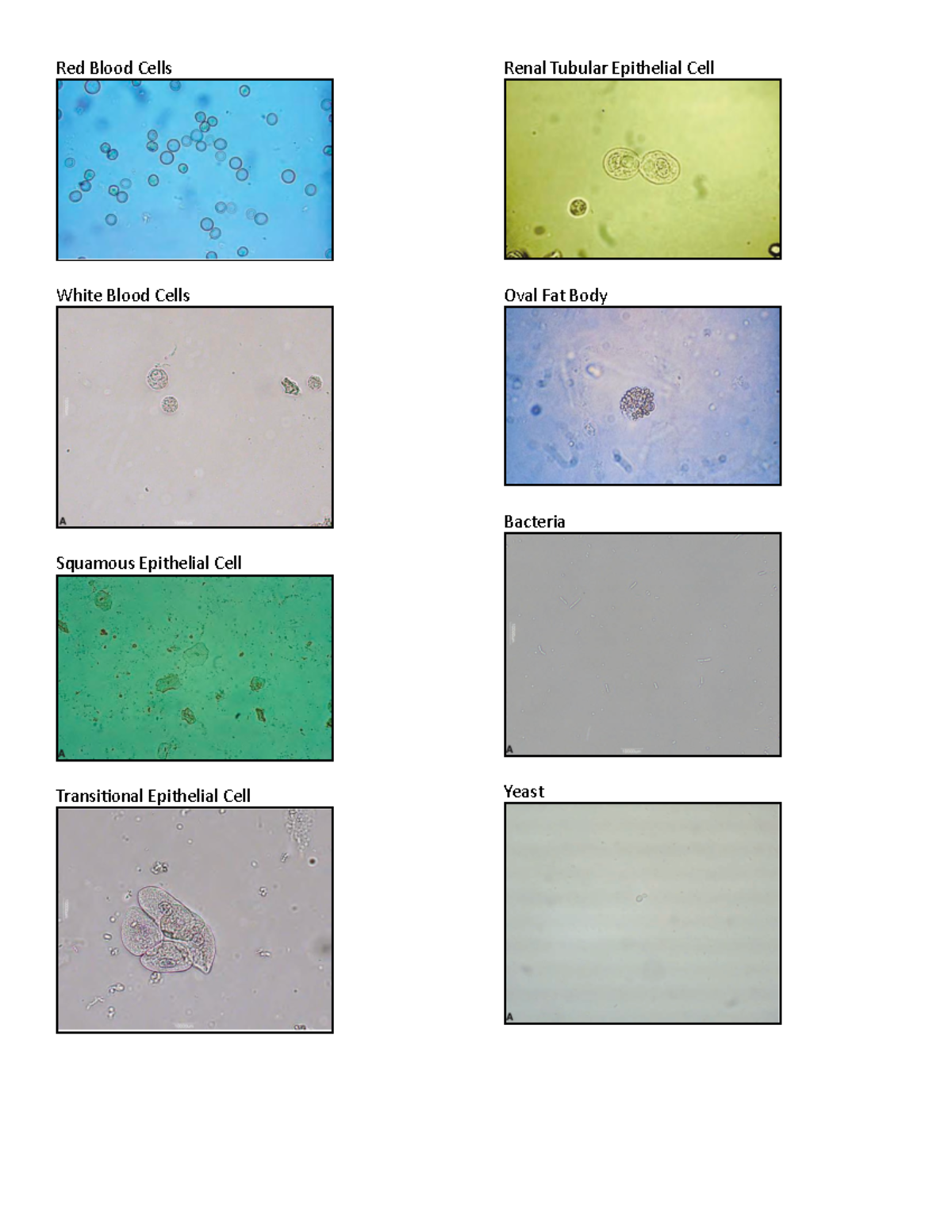Urine- Sediments- Constituents - Red Blood Cells White Blood Cells ...